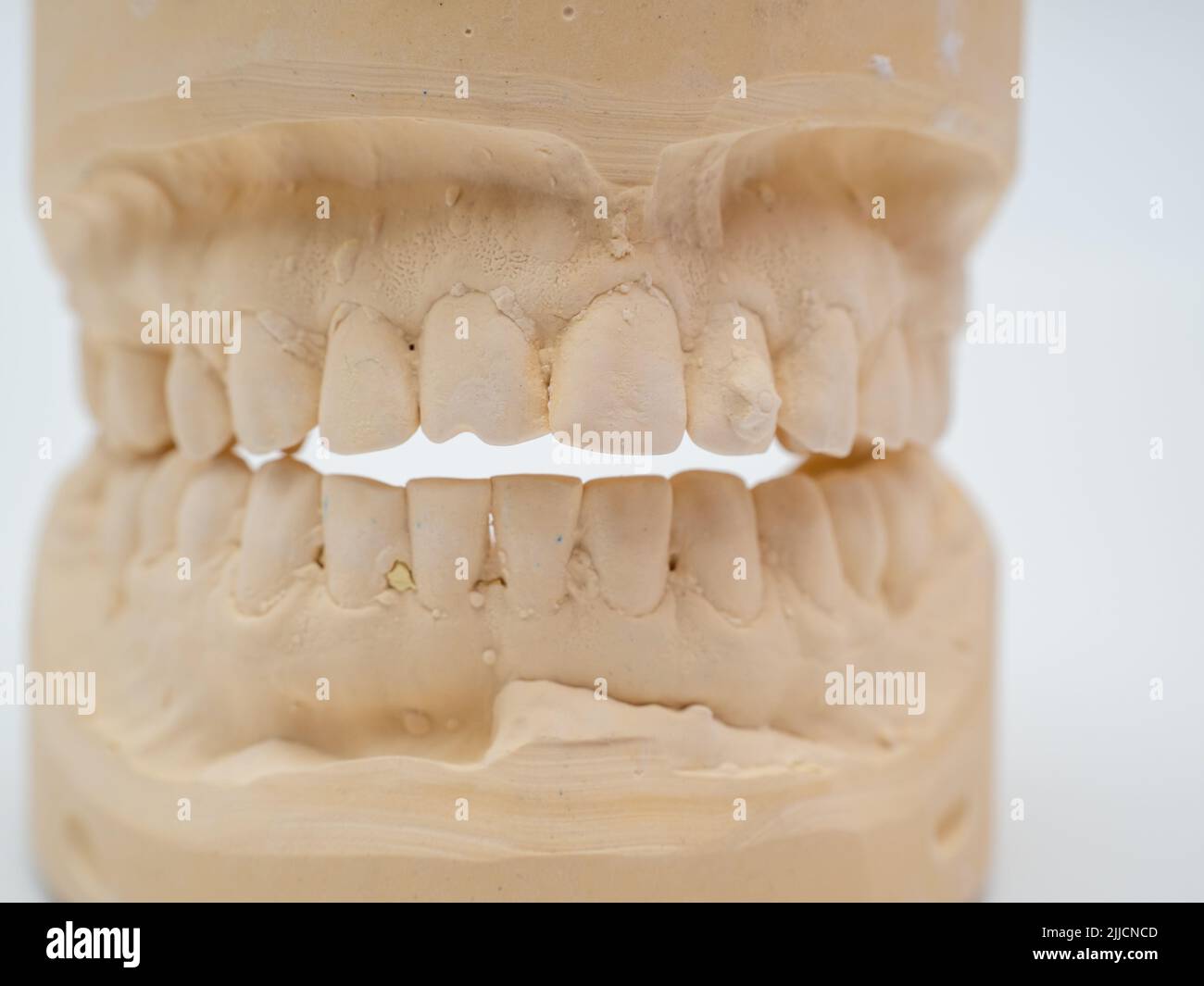 Plaster model or cast of human teeth. Teeth model on a white background ...