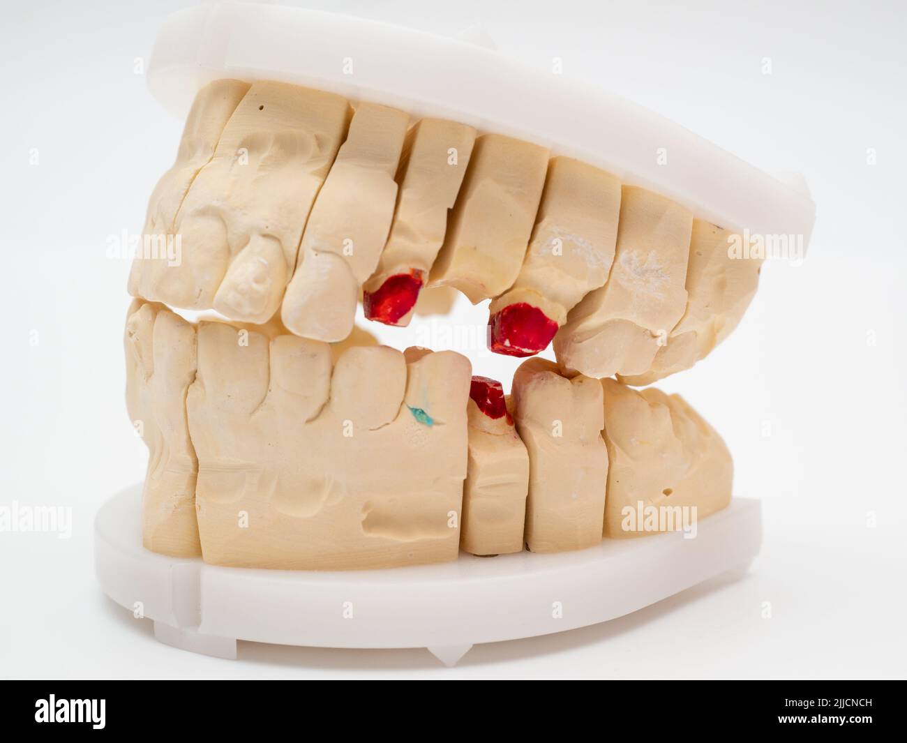 Plaster model or cast of human teeth. Teeth model on a white background ...