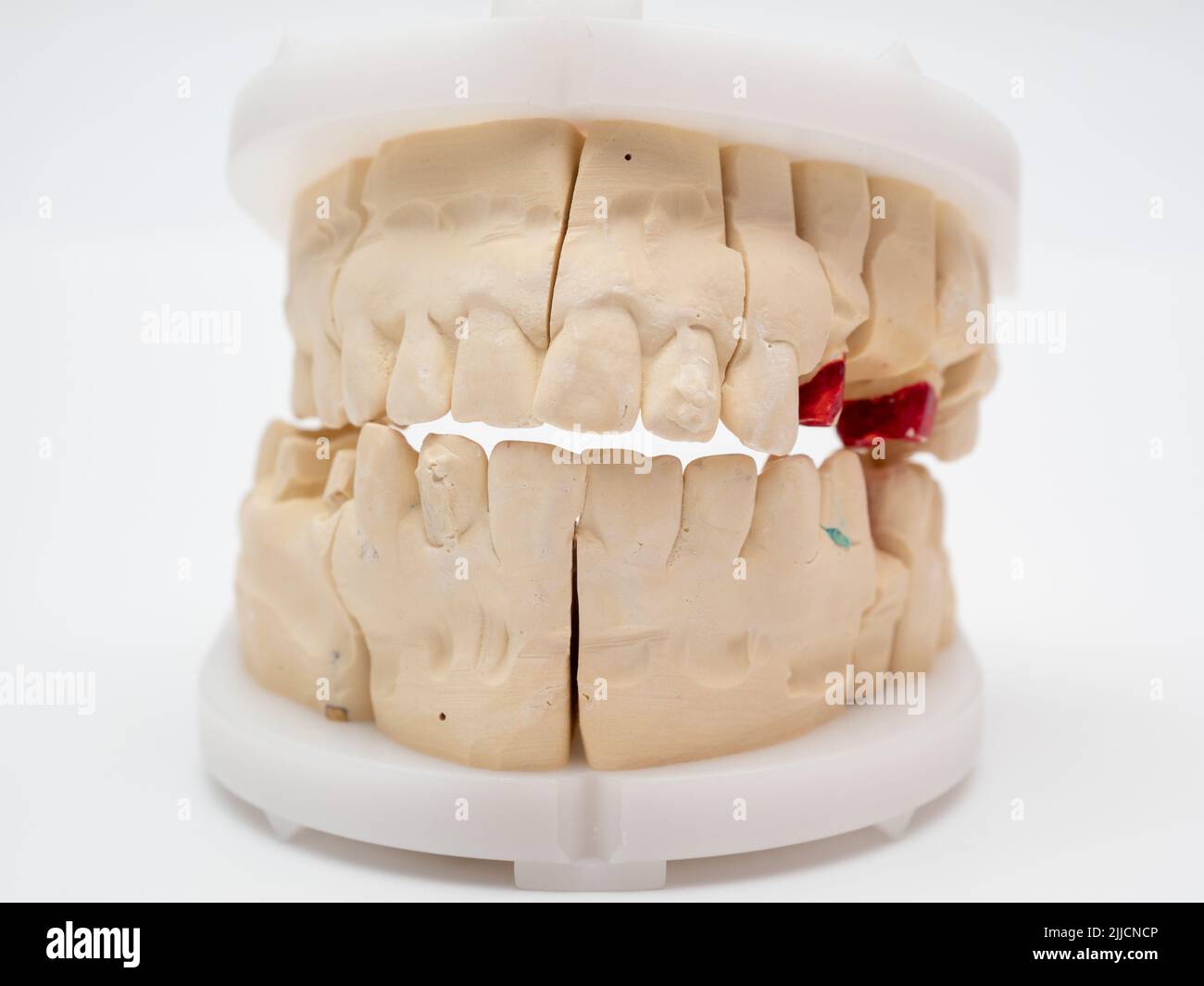 Plaster model or cast of human teeth. Teeth model on a white background ...