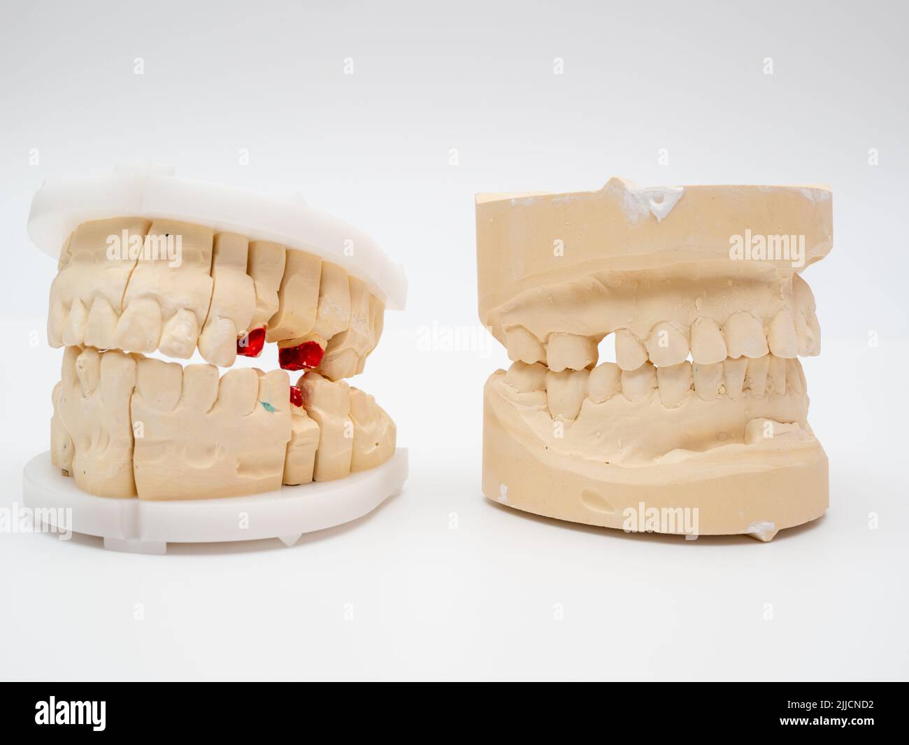 Plaster model or cast of human teeth. Teeth model on a white background ...