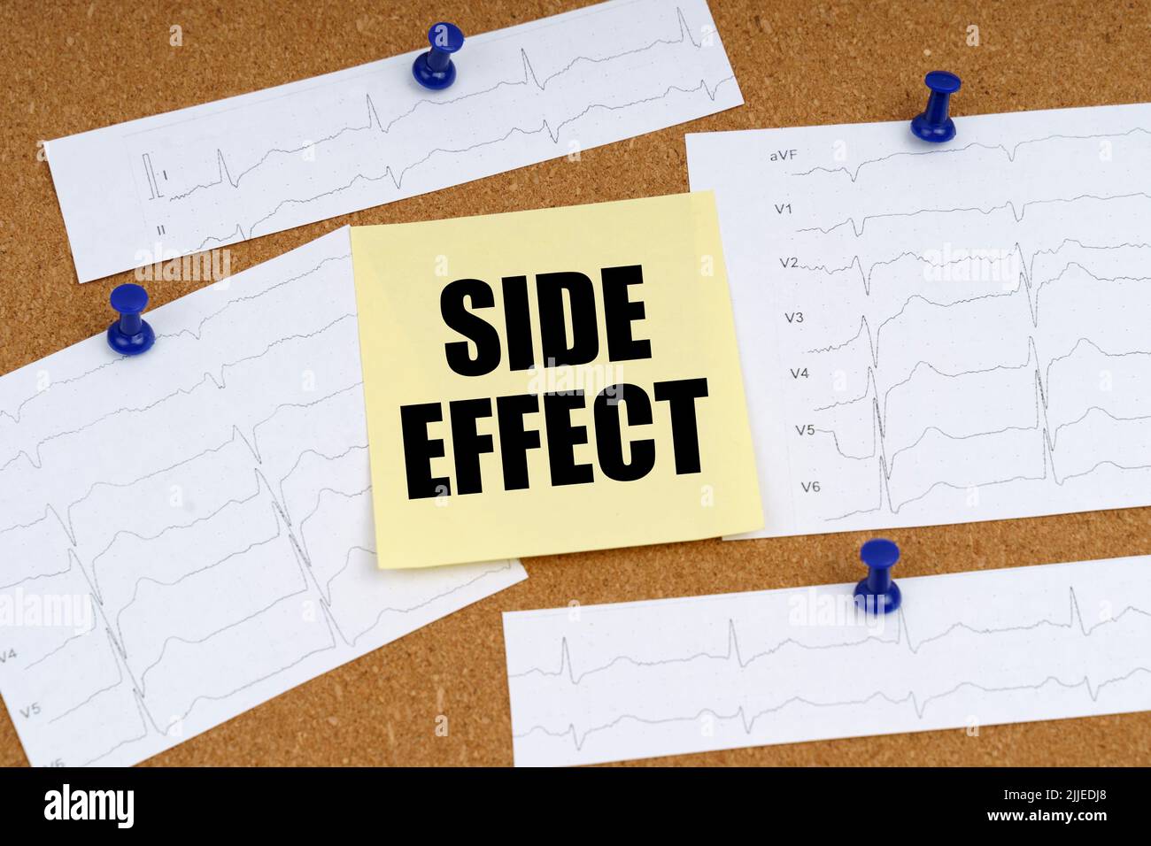 Medicine and health concept. Attached to the board are cardiogram ...