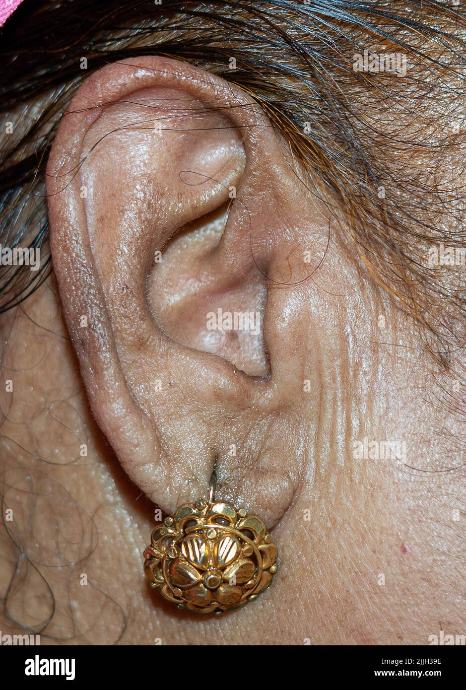Ear close-up shot or ear ent doctor check Stock Photo - Alamy