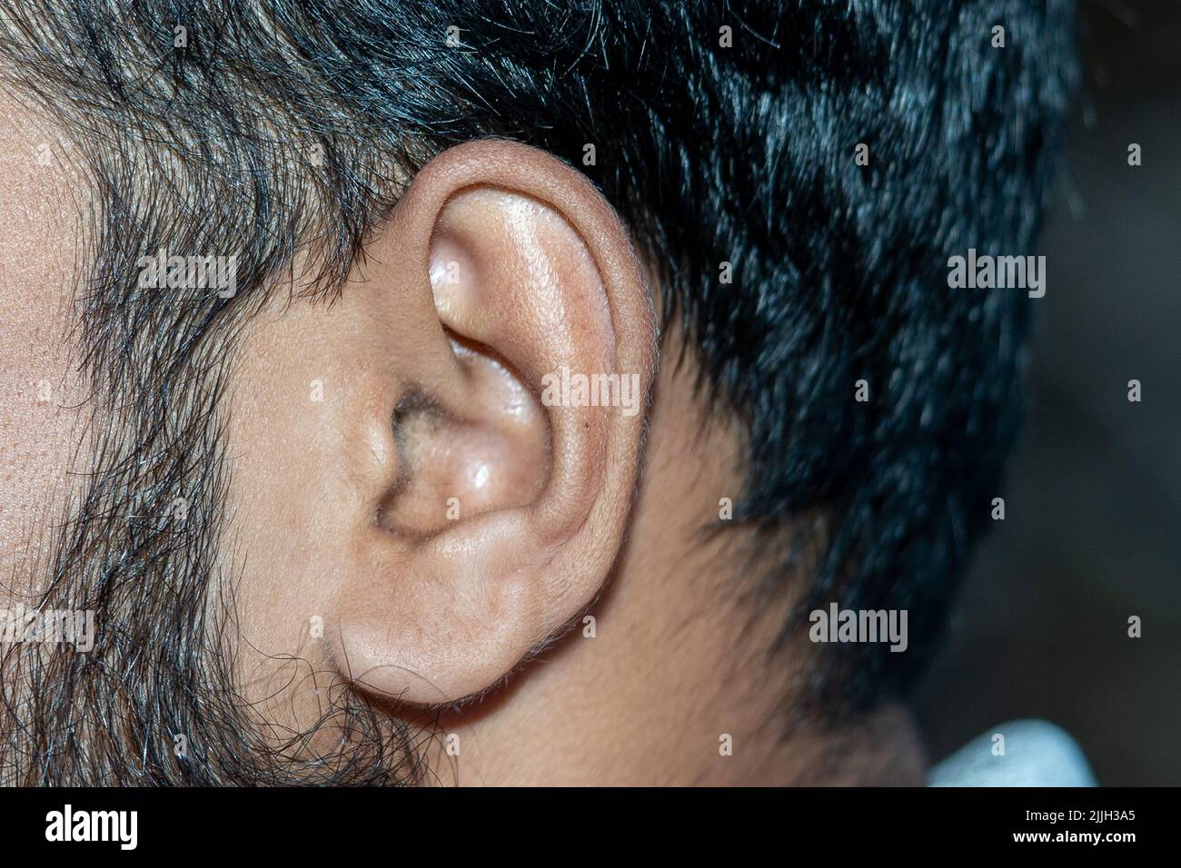 human ear close-up shot or ear ent doctor check Stock Photo - Alamy