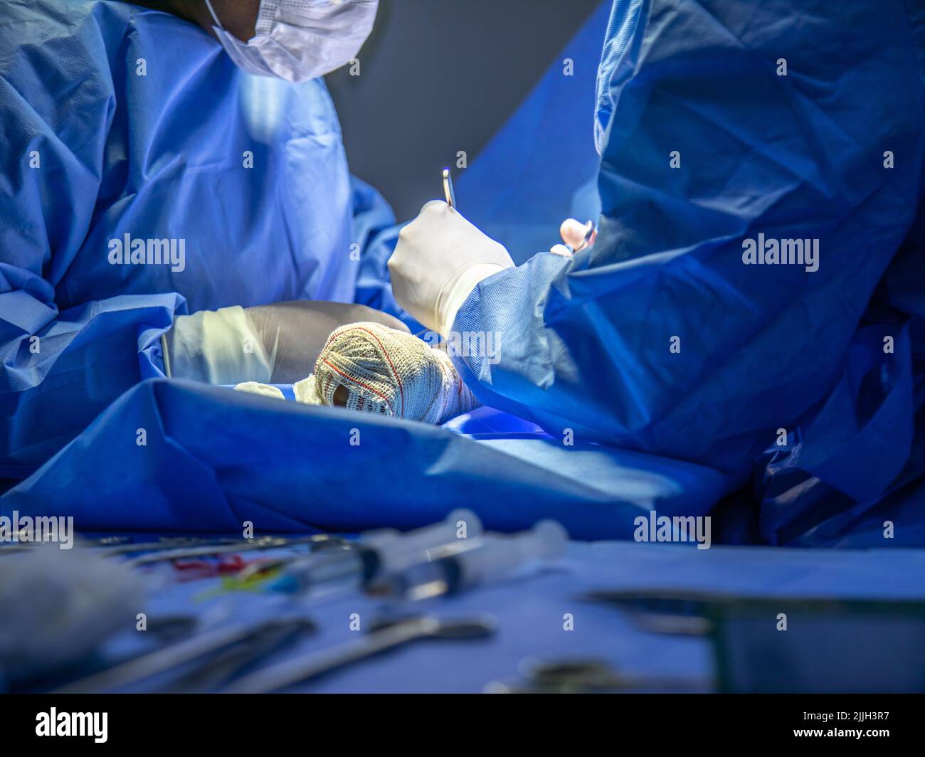 surgical center in procedure fistula for dialysis focus selective and ...