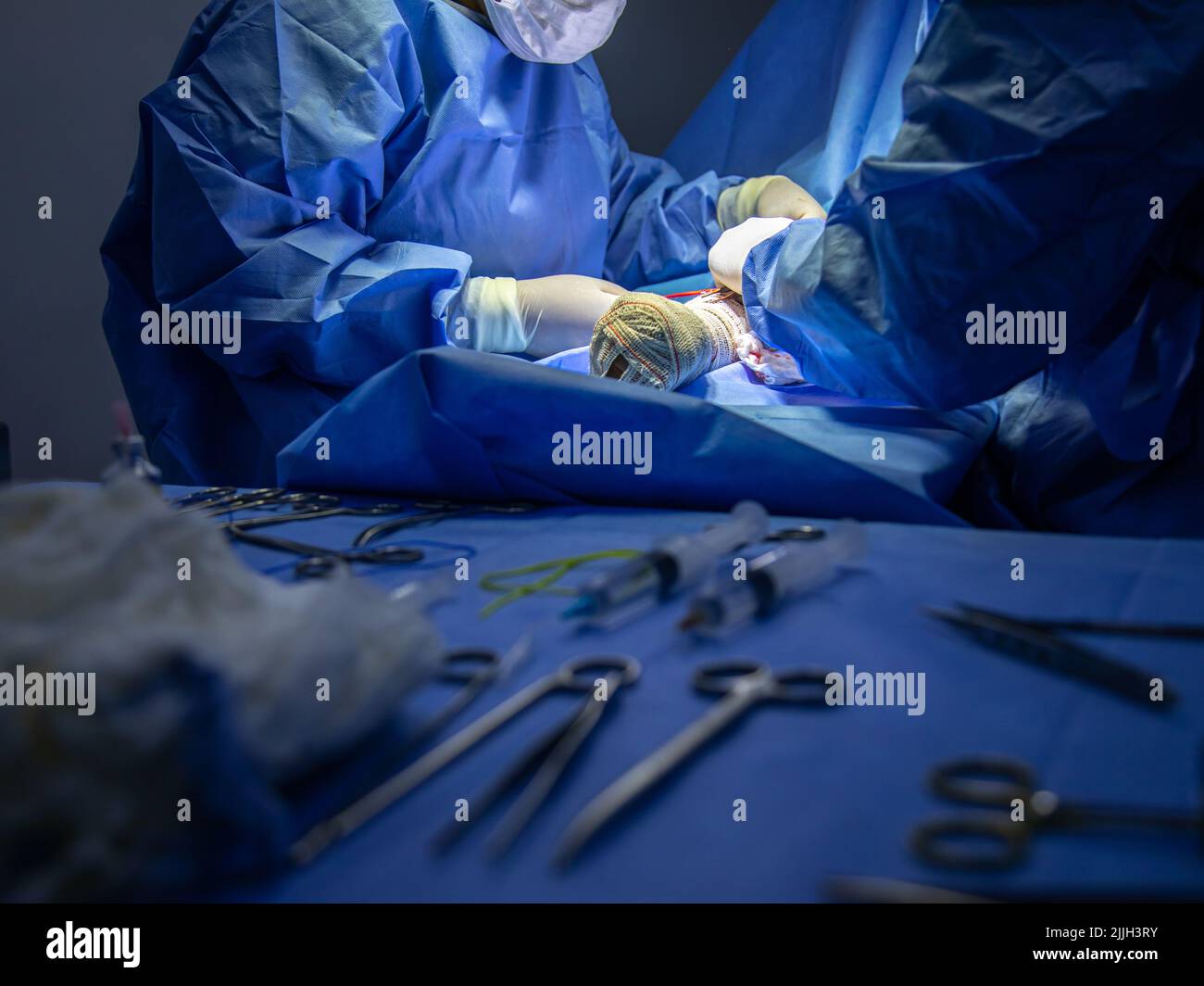 surgical center in procedure fistula for dialysis focus selective and ...