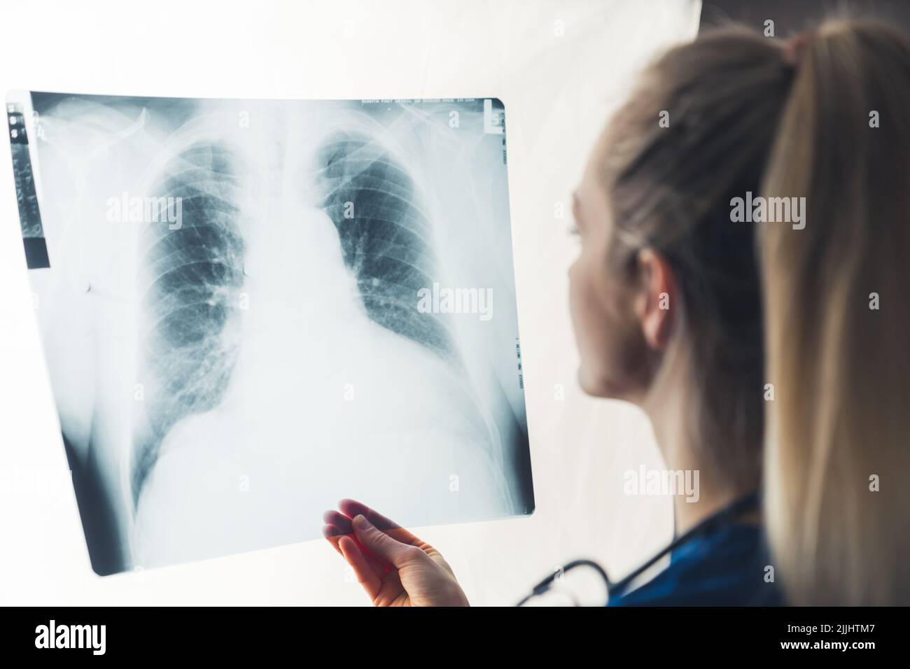 Illuminated lung x-ray held by a young European female pulmonologist ...