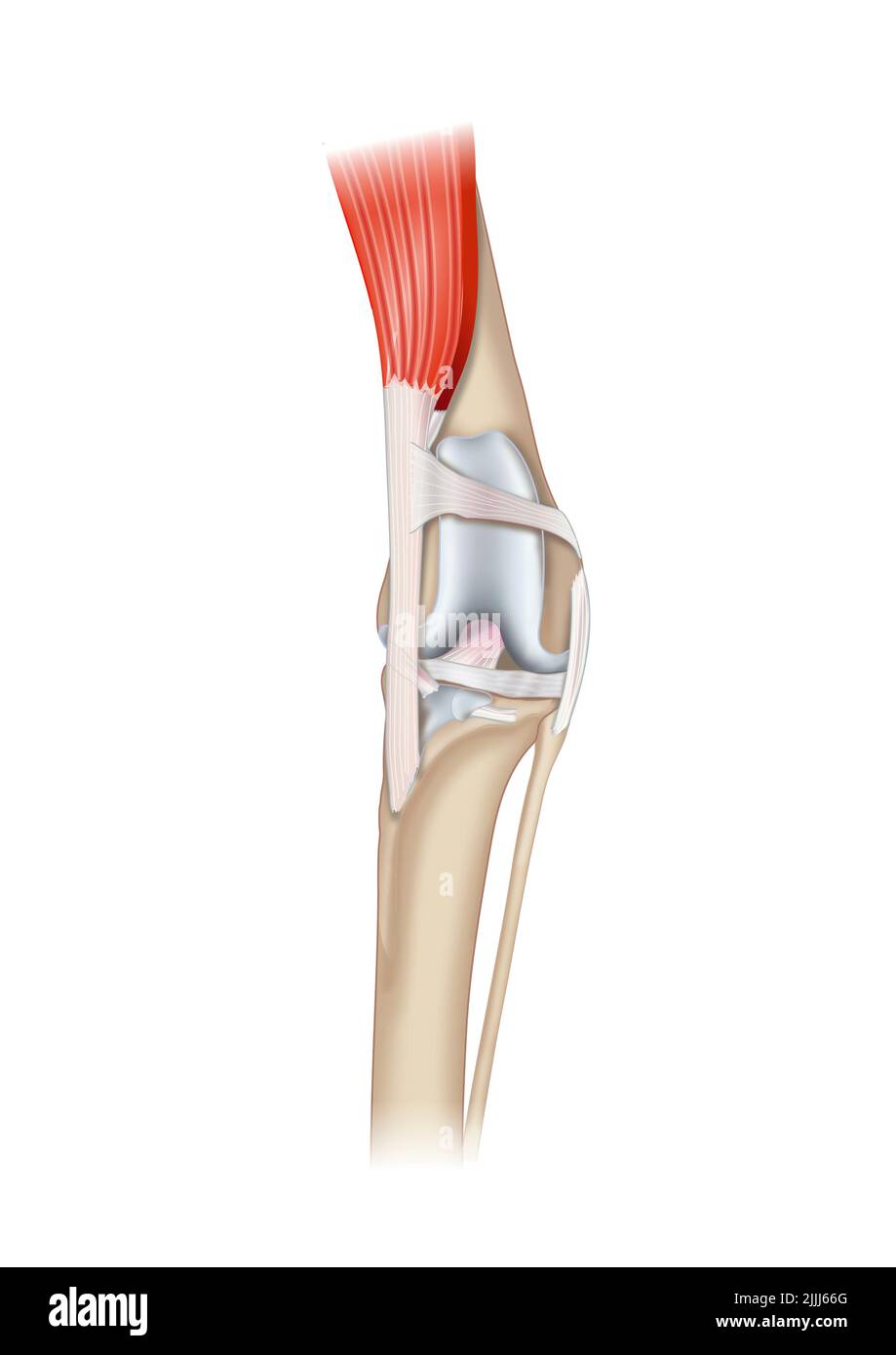 Dislocated kneecap, illustration Stock Photo - Alamy