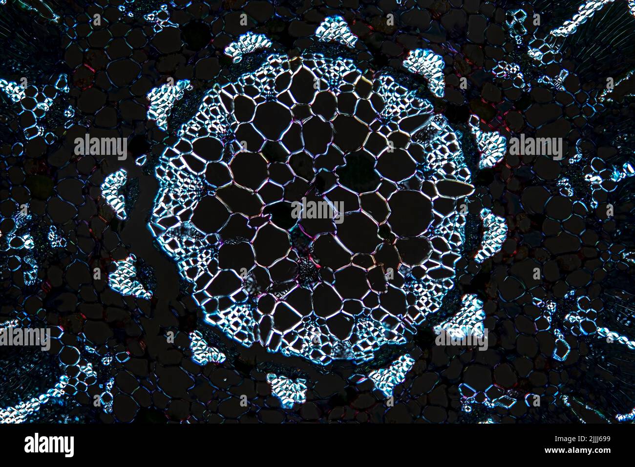 Casuarina sp. tree, fluorescent light micrograph Stock Photo - Alamy Casuarina sp. tree, fluorescent light micrograph Stock Photo - Alamy