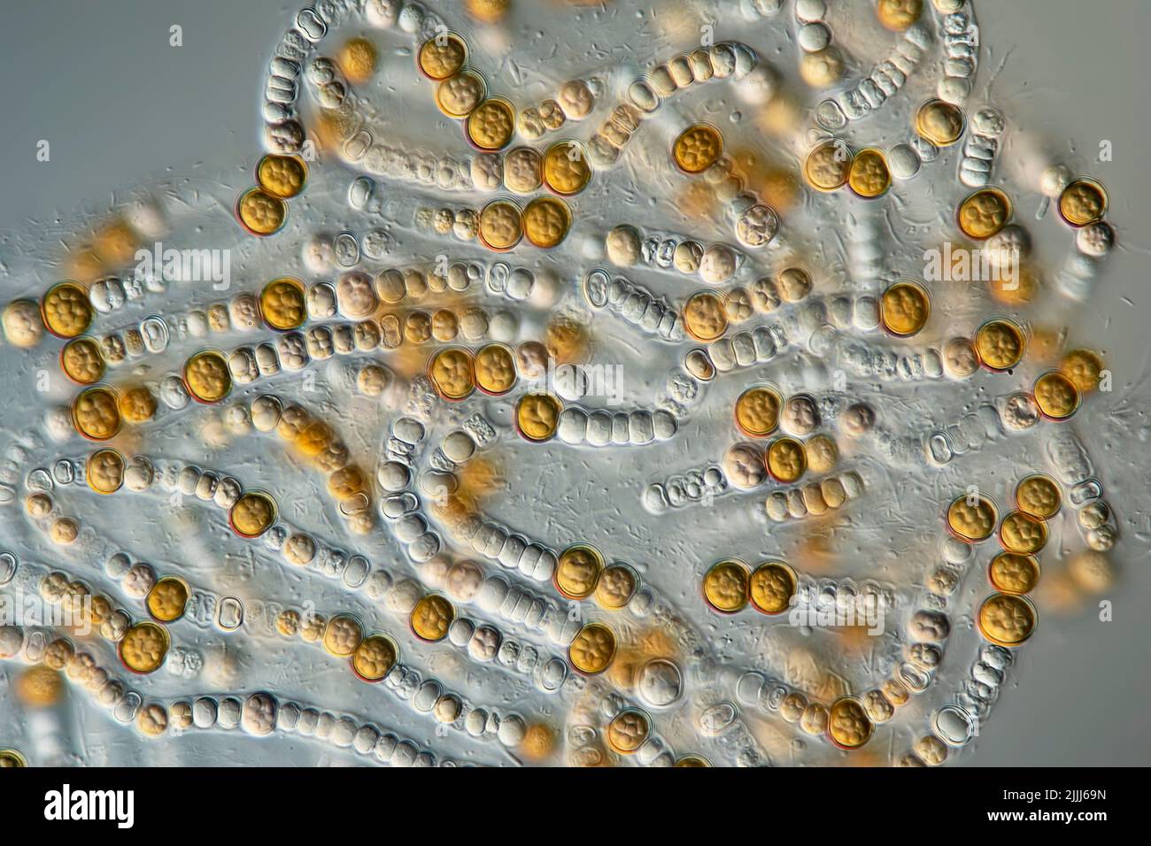 Anabaena sp. algae, light micrograph Stock Photo - Alamy