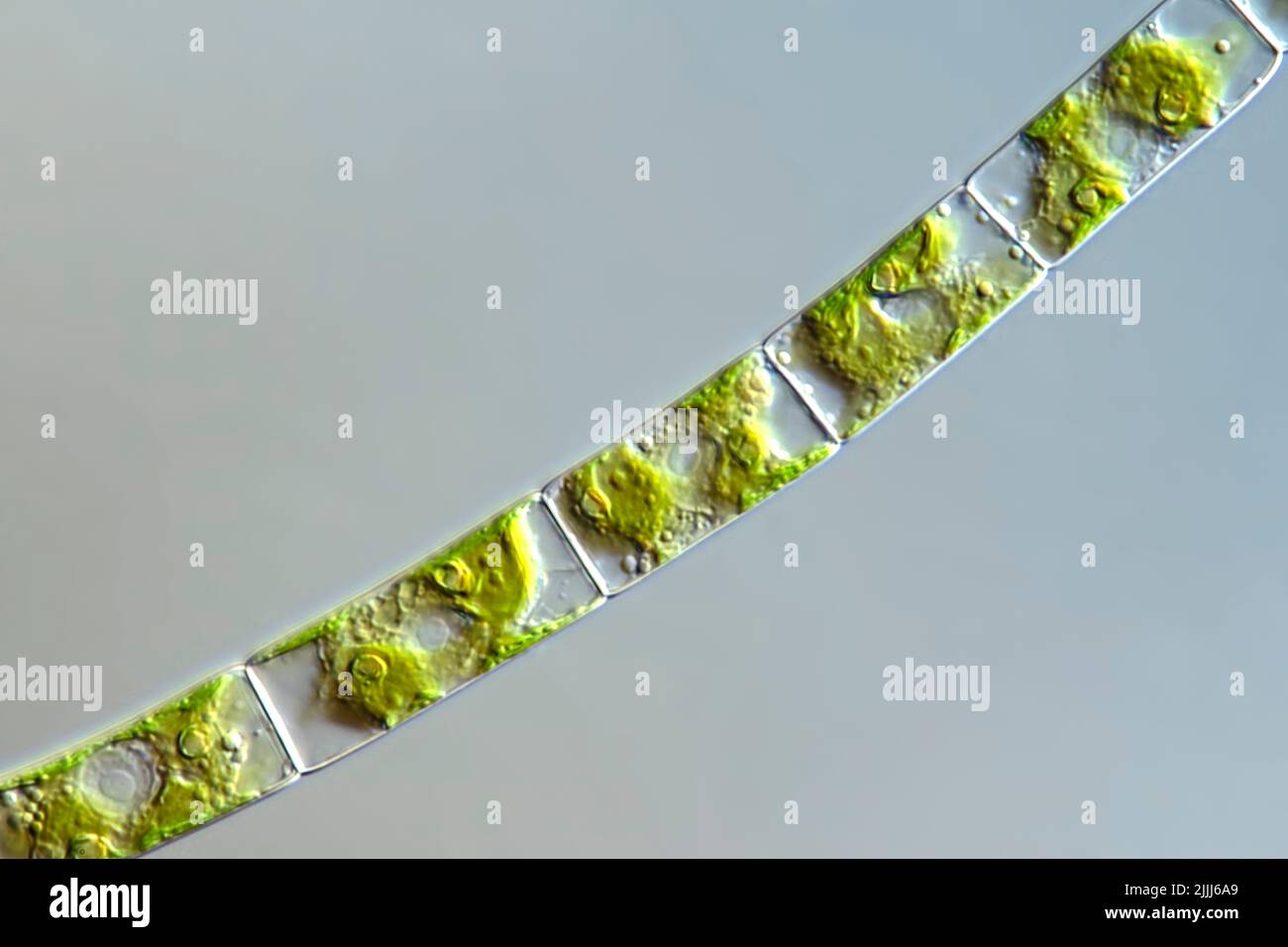 Uronema sp. algae, light micrograph Stock Photo - Alamy