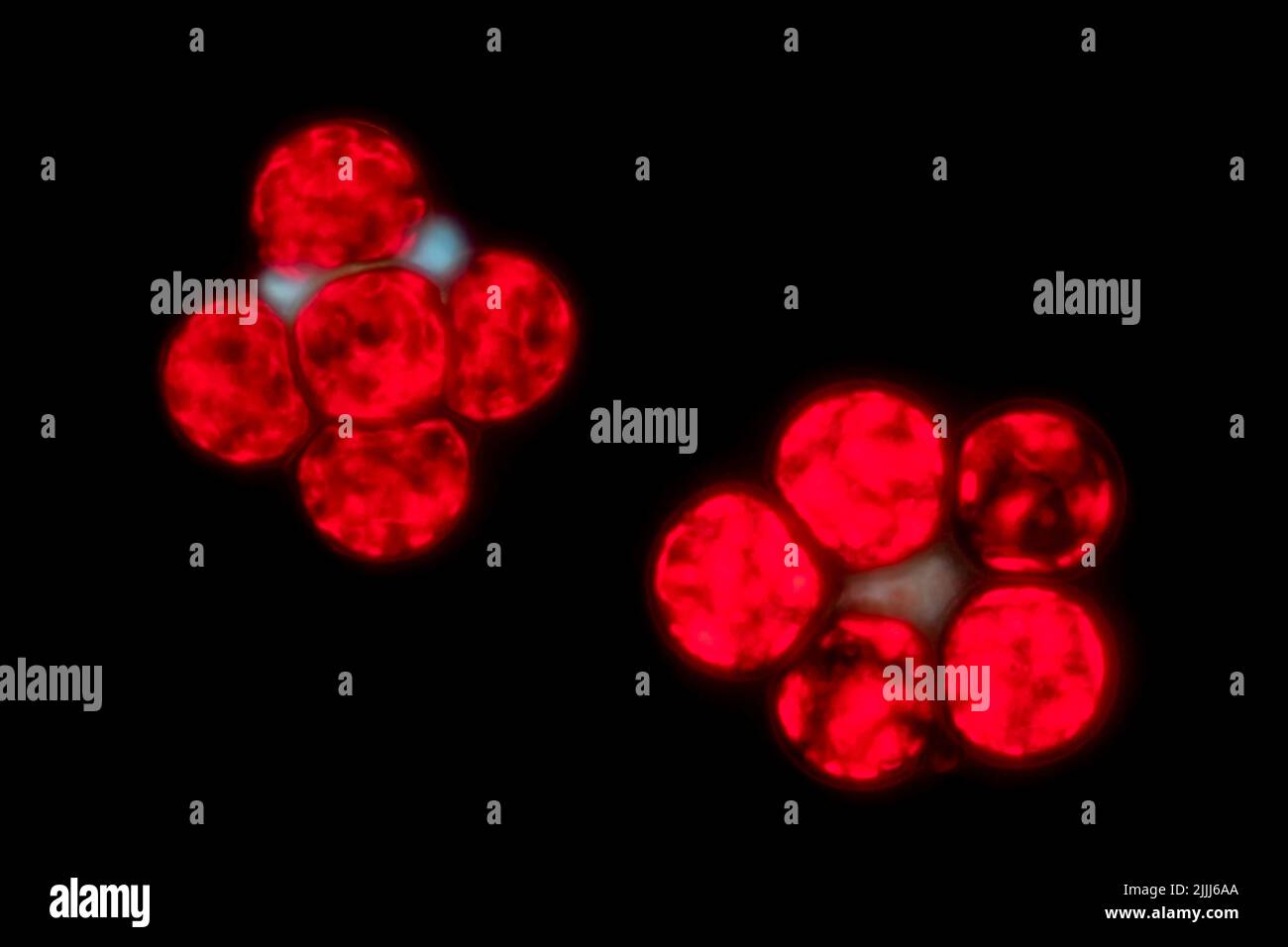 Coenochloris fottii cf. algae, light micrograph Stock Photo - Alamy