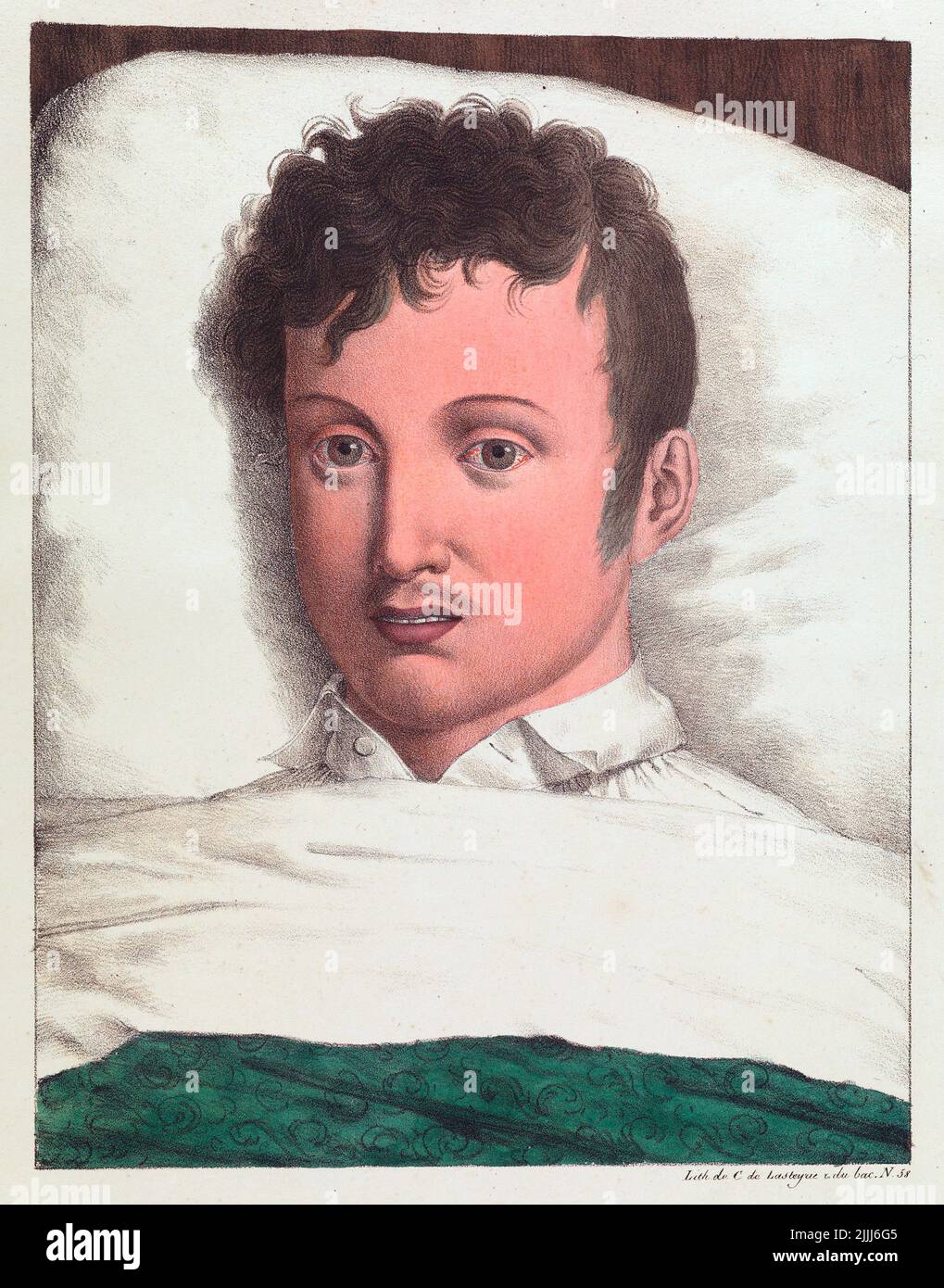 Yellow fever sequence, 19th century illustration Stock Photo - Alamy