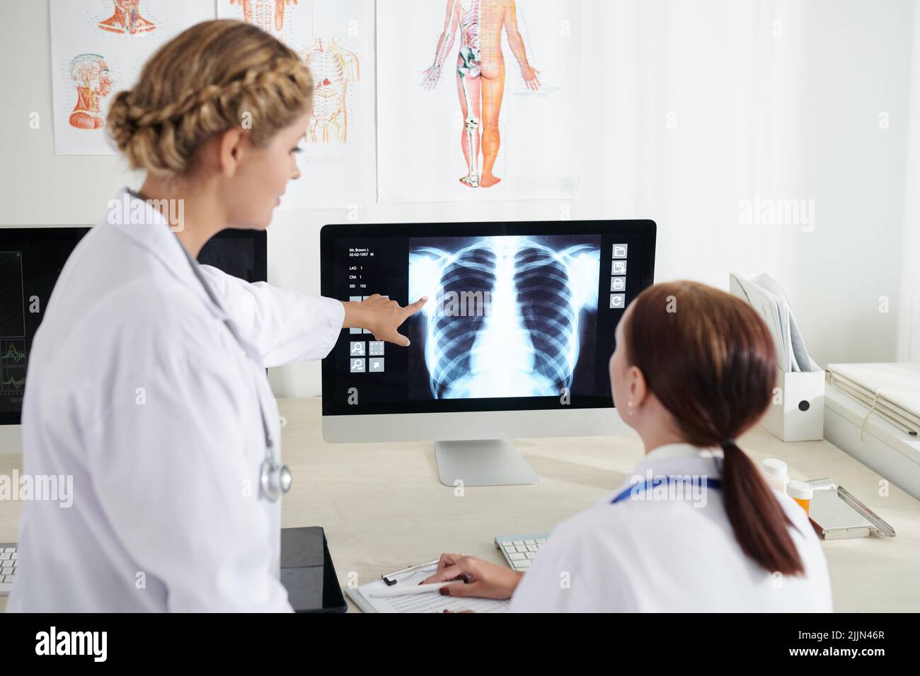 Pulmonologust and surgeon discussing chest x-ray of sick patient on ...