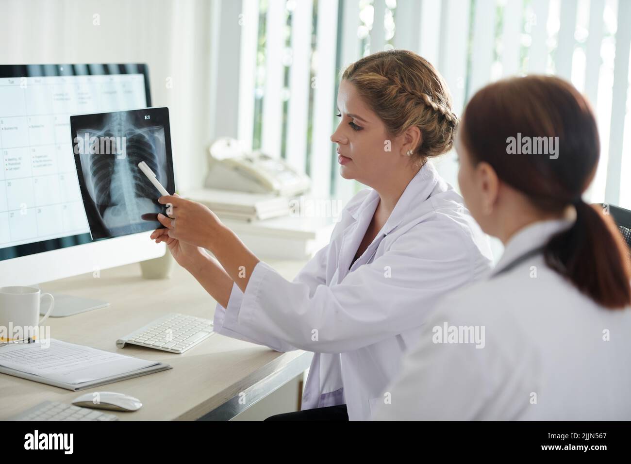 Pulmonologists discussing dark spots on lungs x-ray of patient Stock ...