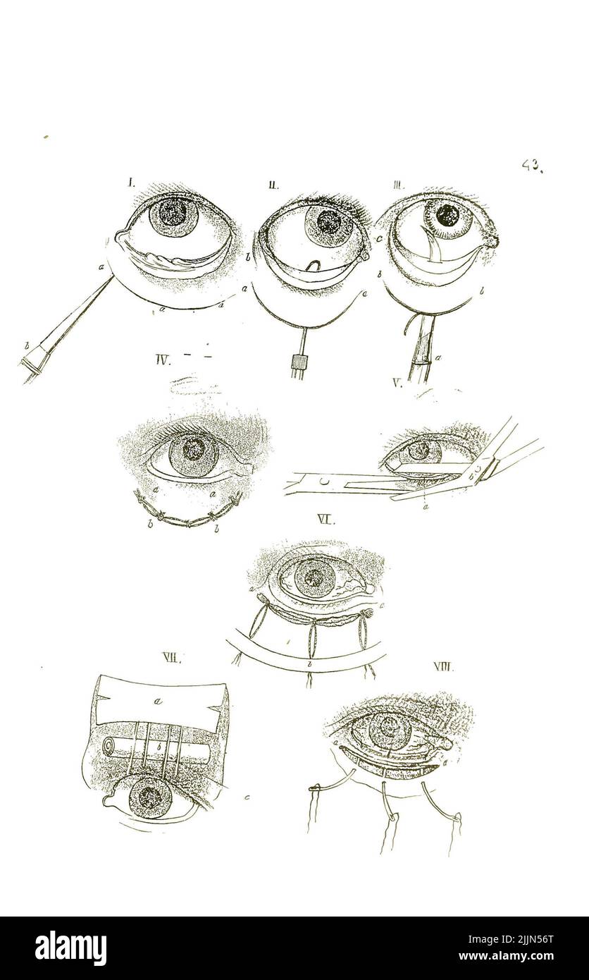 Medieval anatomy hi-res stock photography and images - Alamy