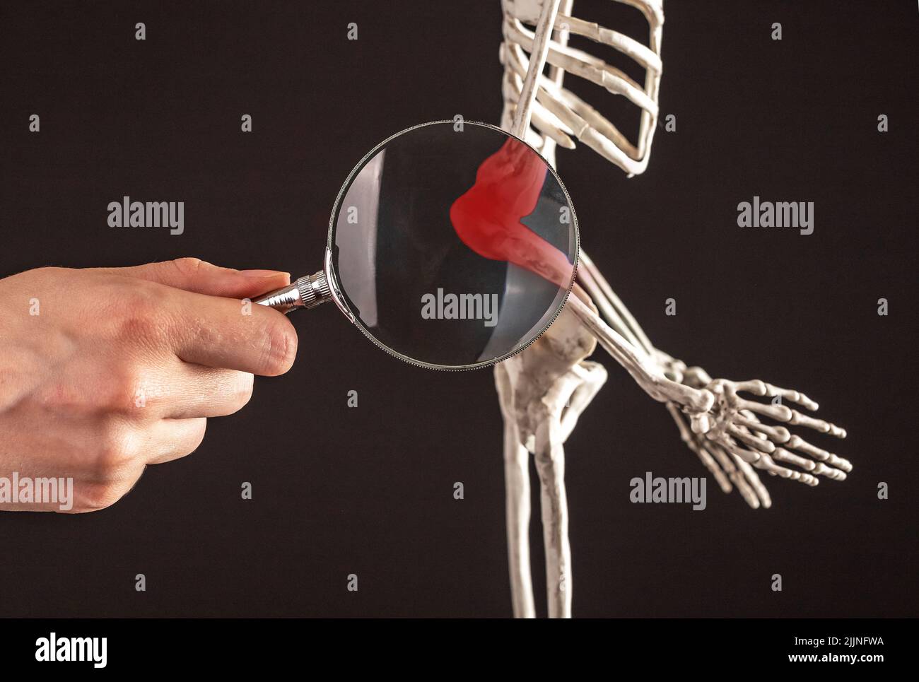 Hand with magnifying glass over elbow bones of human skeleton with red ...