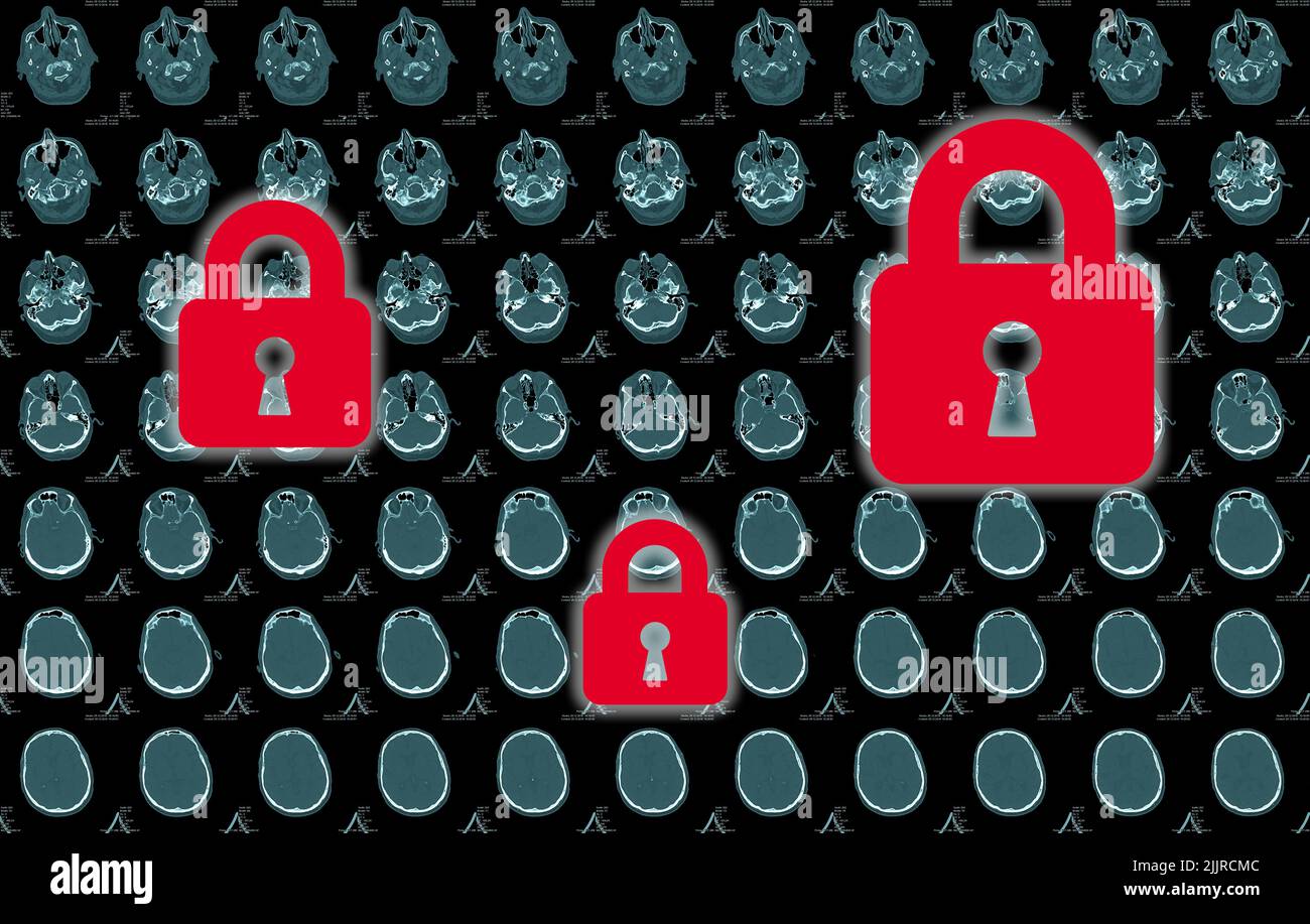 A head MRI with symbols of red locks in front of it Stock Photo - Alamy