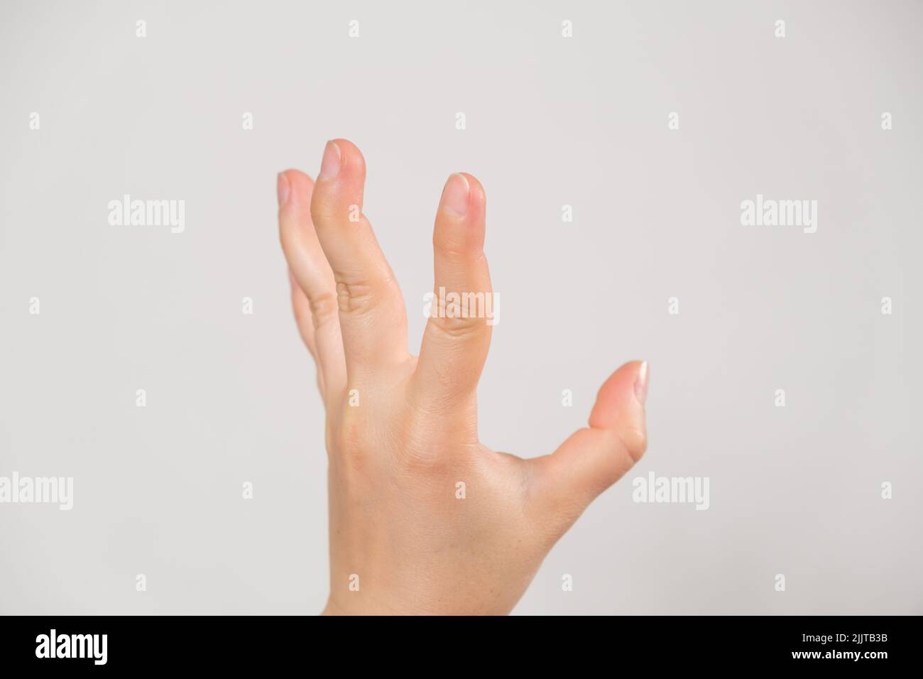 A human hand with an unnaturally bent joint. Ankylosis of the joints of ...