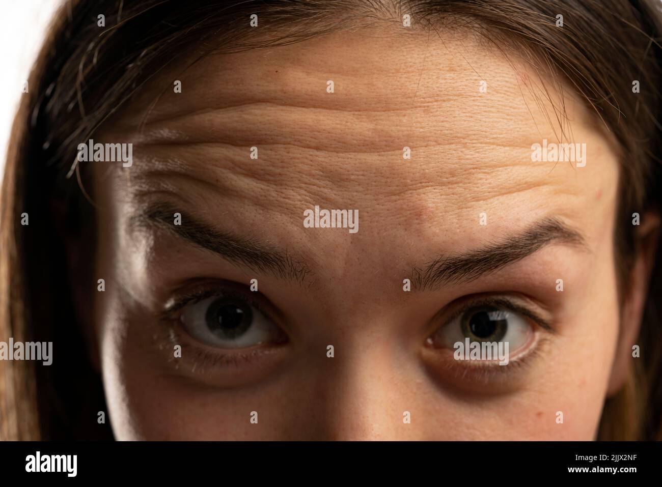 Young caucasian women forehead wrinkles closeup; isolated on white ...
