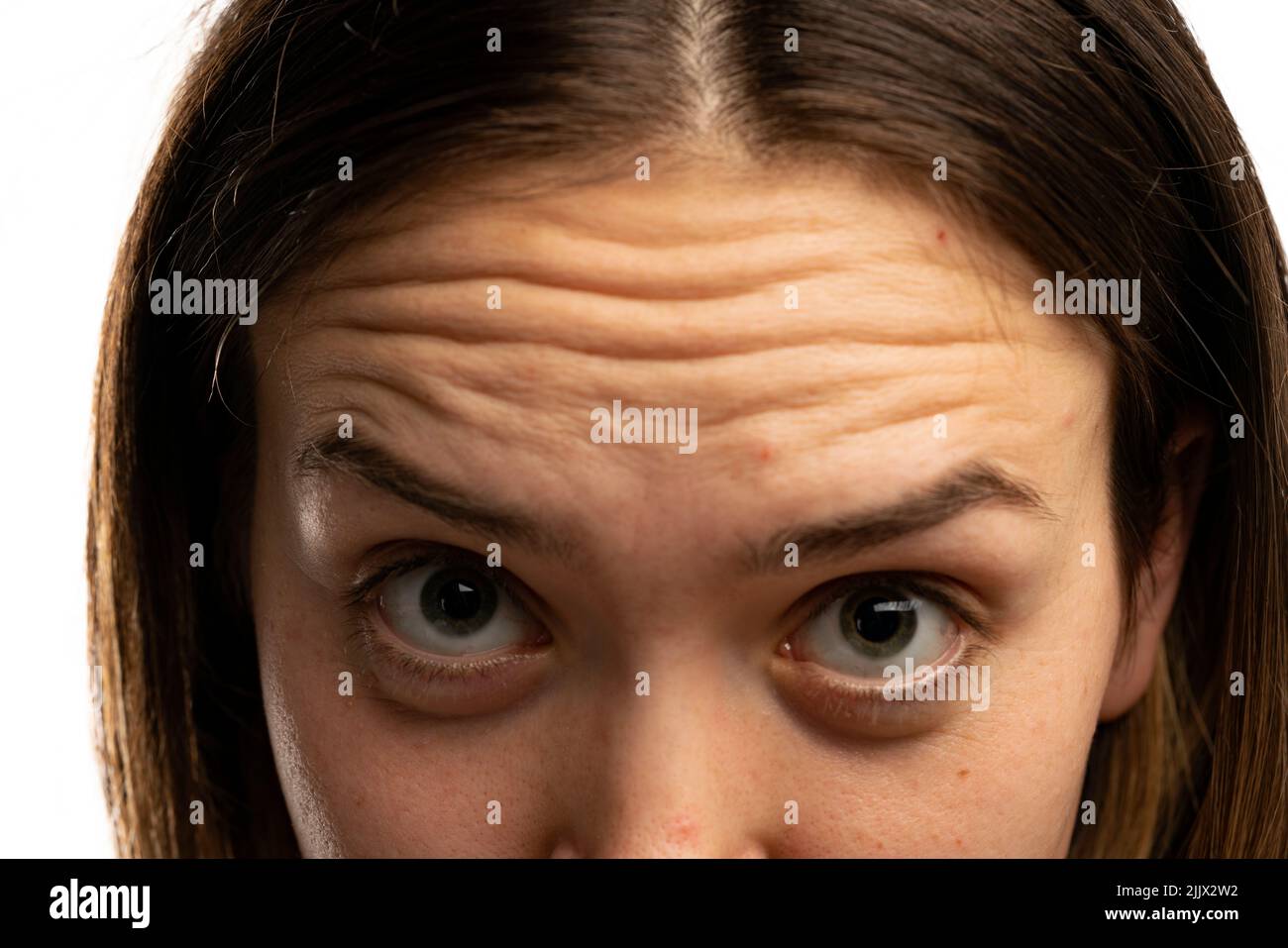 Wrinkled Forehead Angry