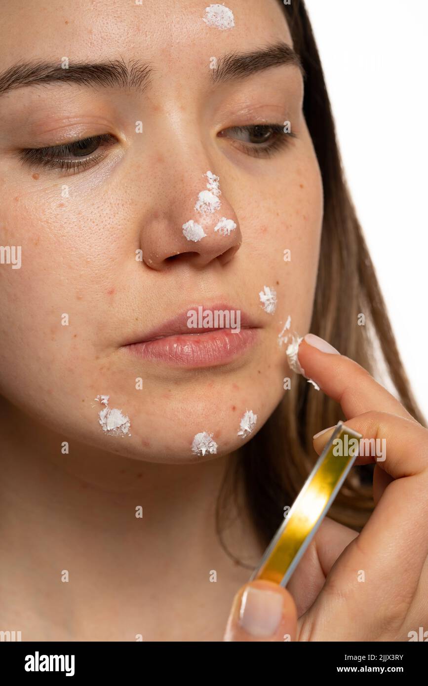 Acne cream hi-res stock photography and images - Alamy