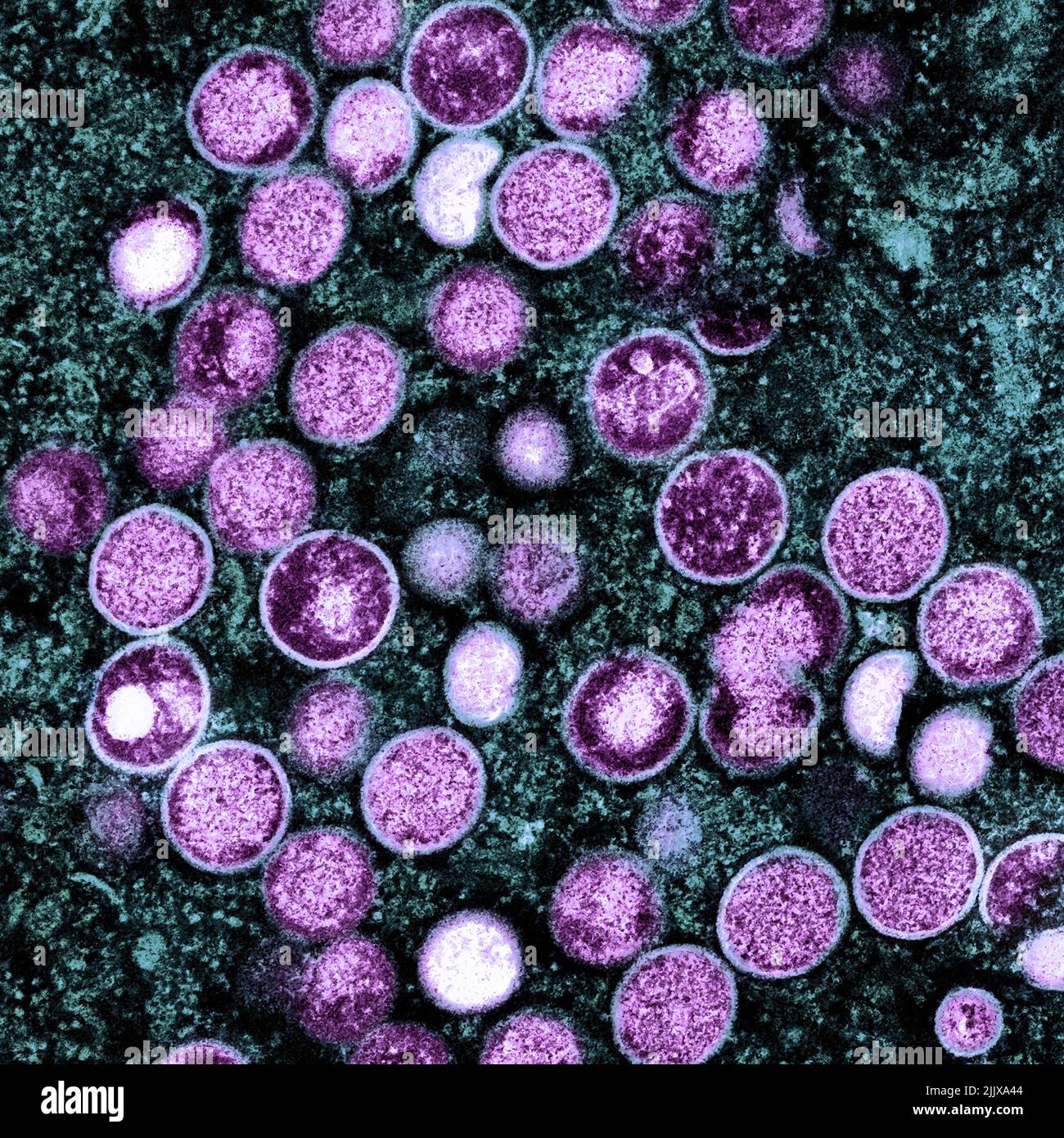 Monkeypox infections hi-res stock photography and images - Alamy