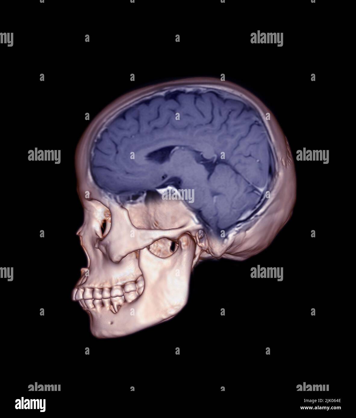 Illustration human brain showing cerebral hi-res stock photography and images - Alamy
