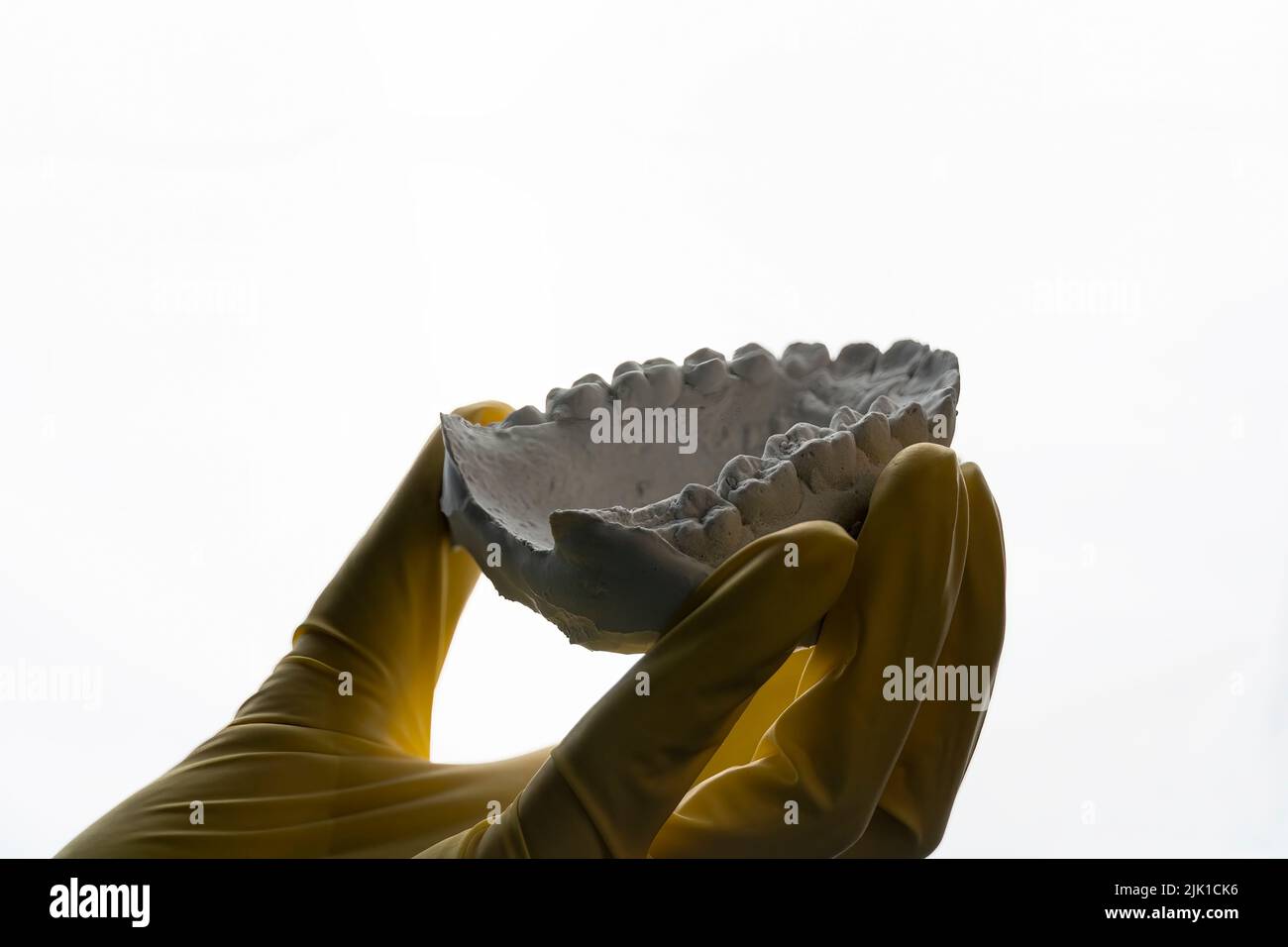 Dental impression patient hi-res stock photography and images - Alamy