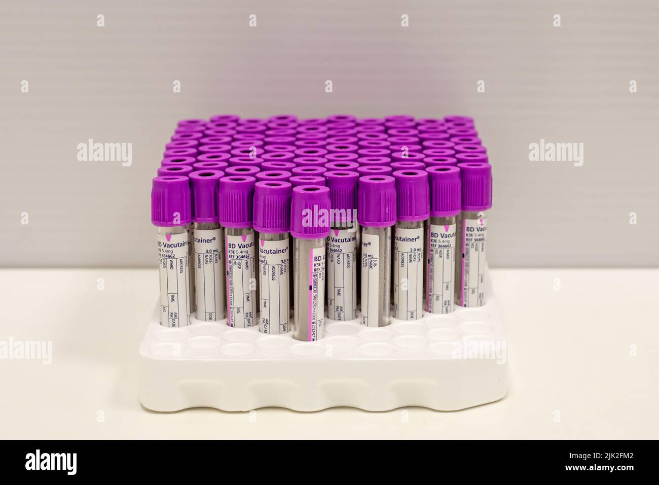 Blood Sample Vacutainer Tubes at Edgar Martindale blog