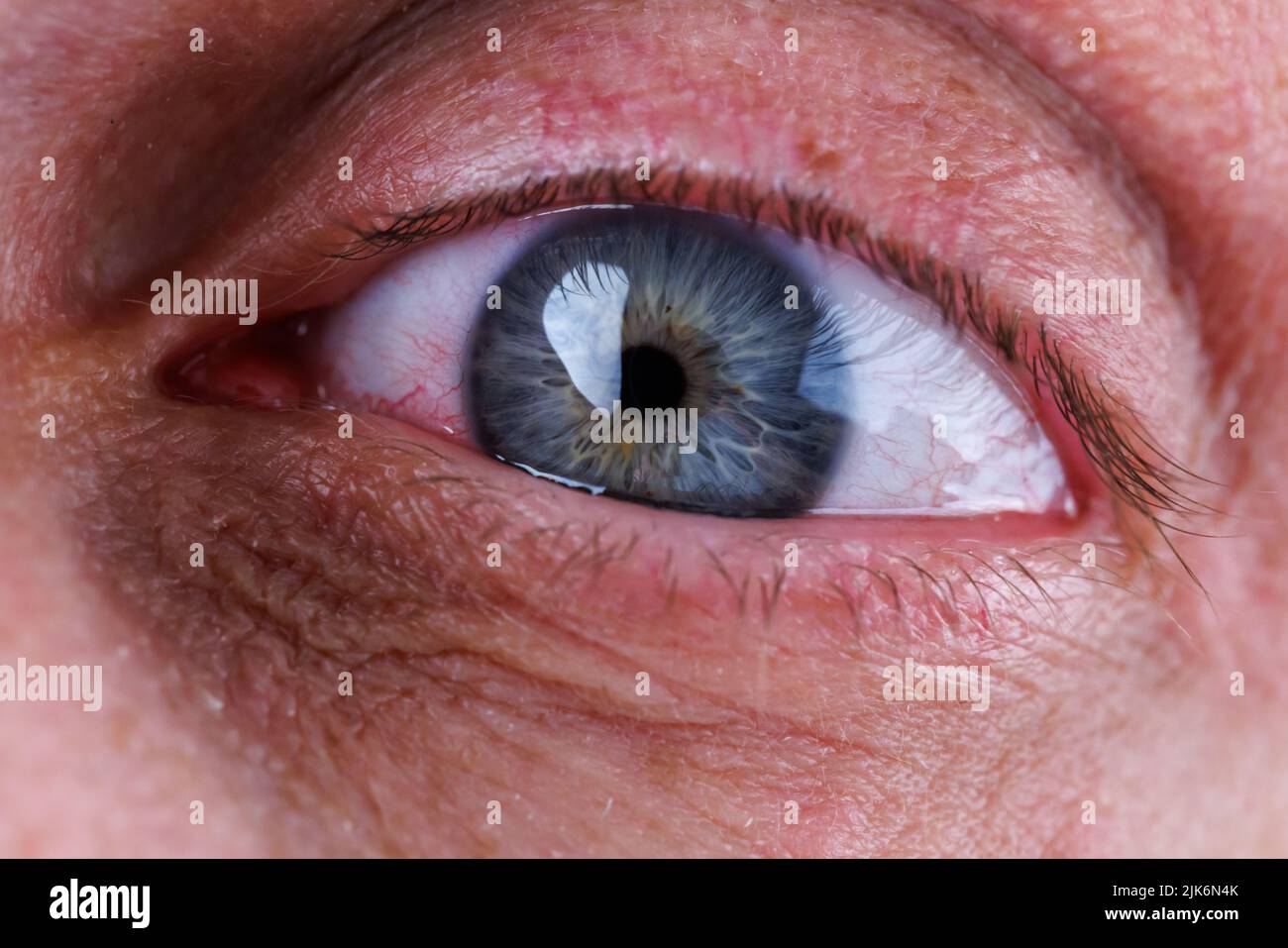 gray eye of caucasian male with red capillary mesh Stock Photo - Alamy
