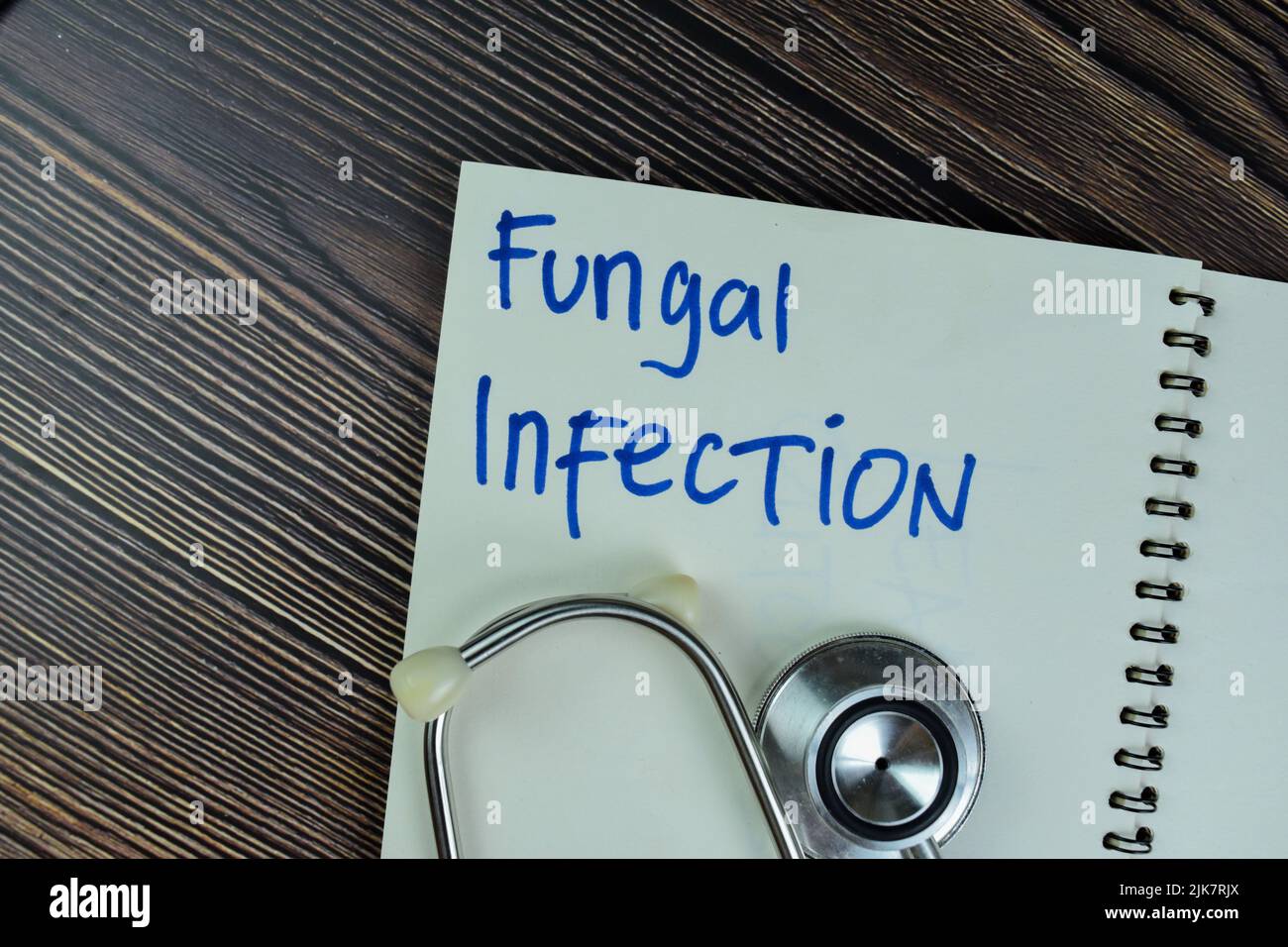 Concept of Fungal Infection write on a book with stethoscope isolated ...