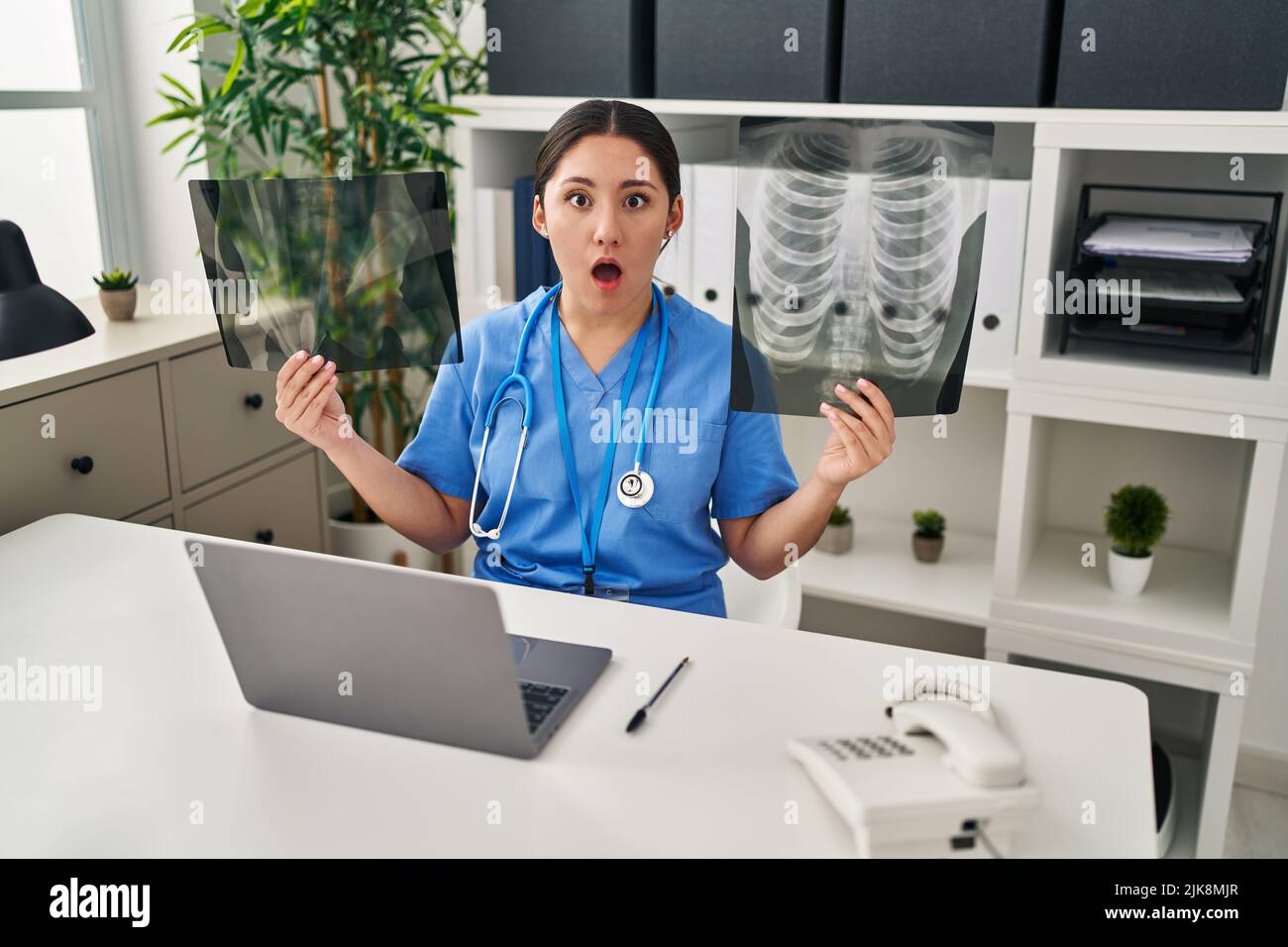 Young latin doctor woman holding x-ray afraid and shocked with surprise ...