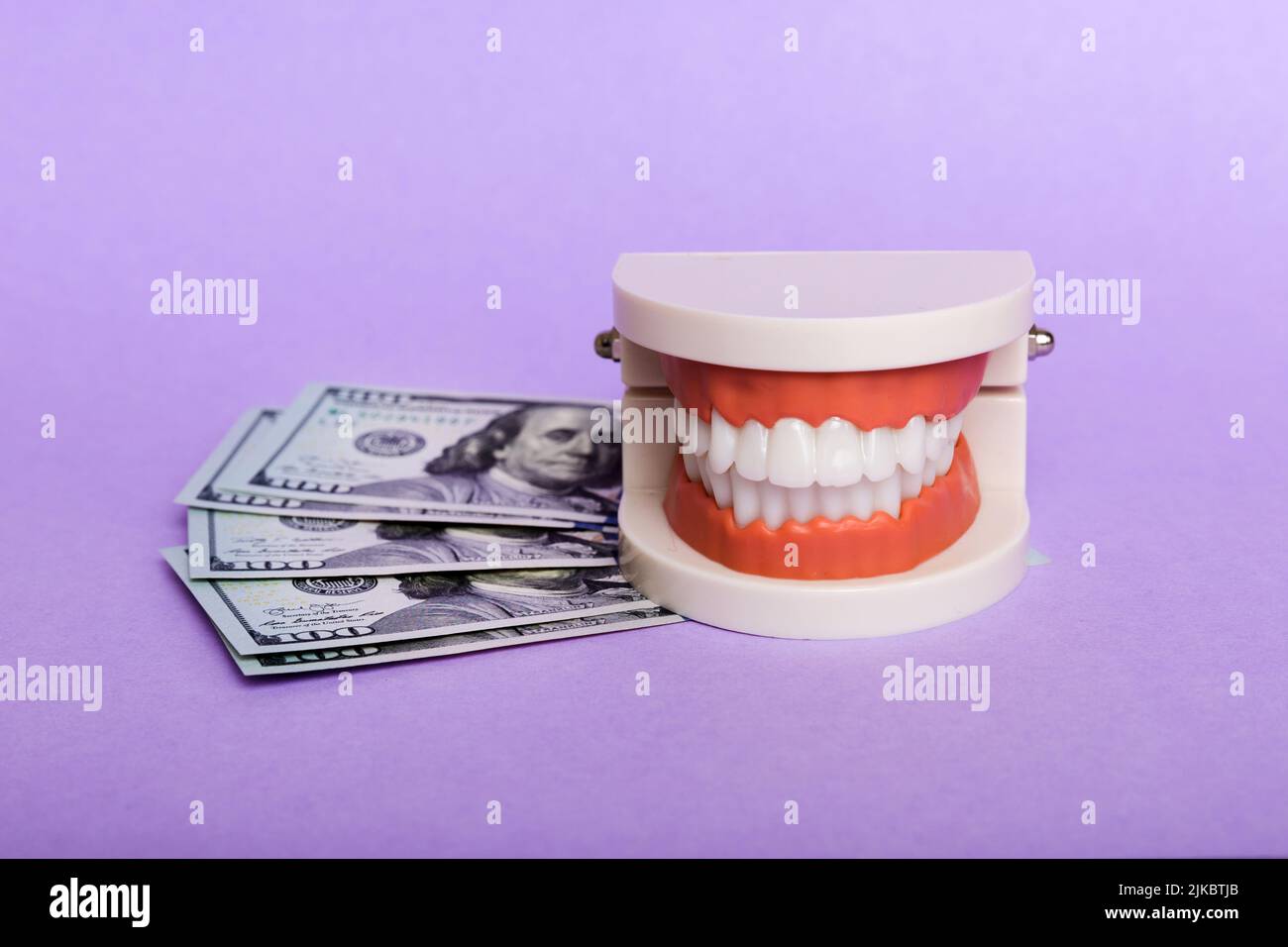 Closeup model of a human jaw with white teeth and dollar bill ...