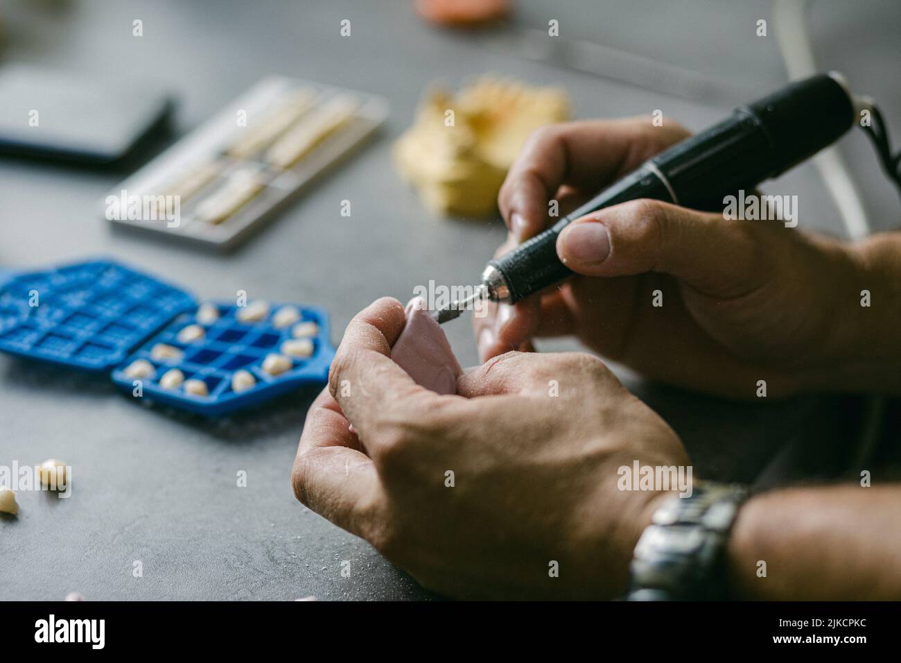 mechanical retention for adhesion of resin of dental prosthesis Stock ...