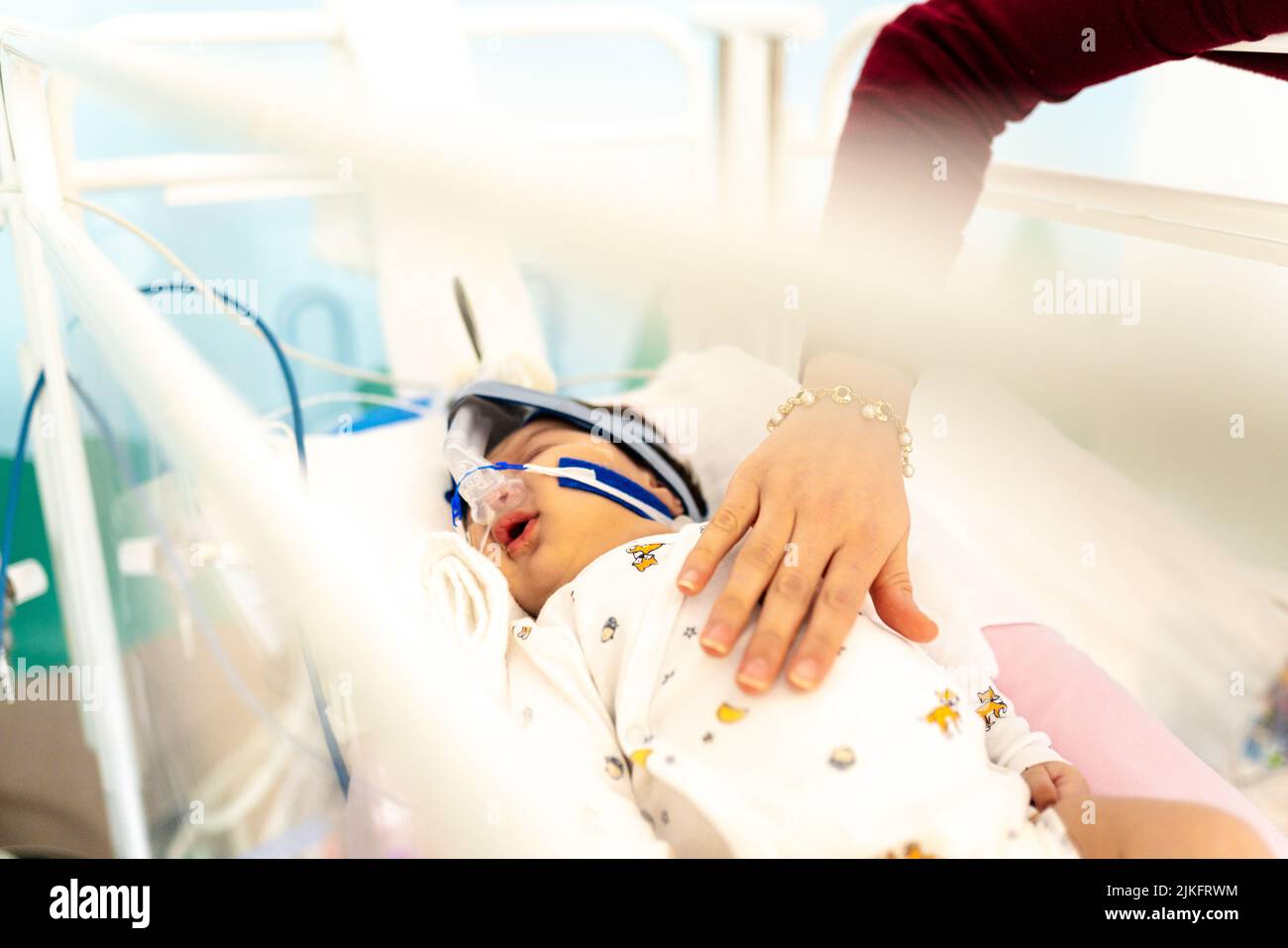 Infant in resuscitation for treatment of bronchiolitis in a hospital ...