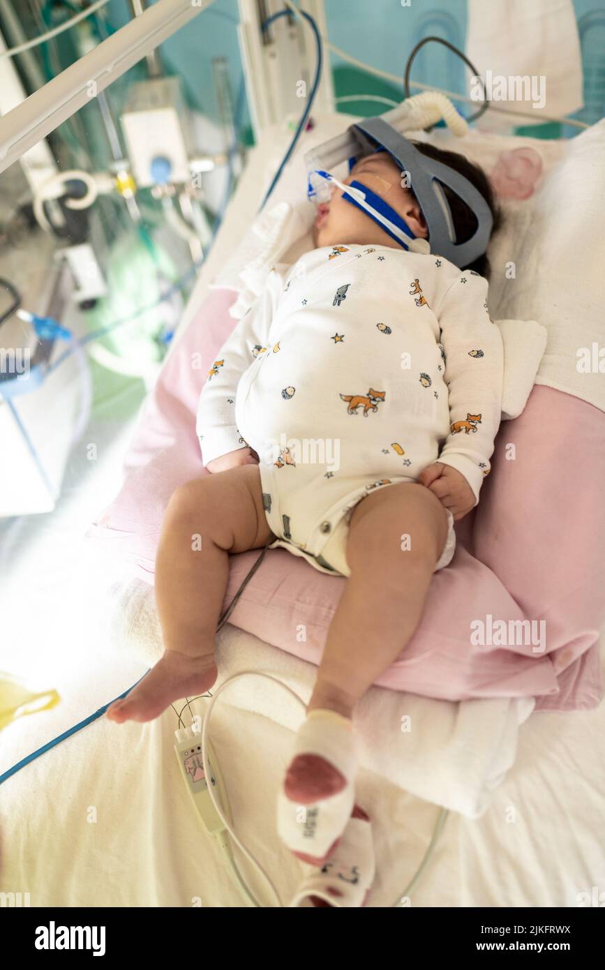 Infant in resuscitation for treatment of bronchiolitis in a hospital ...