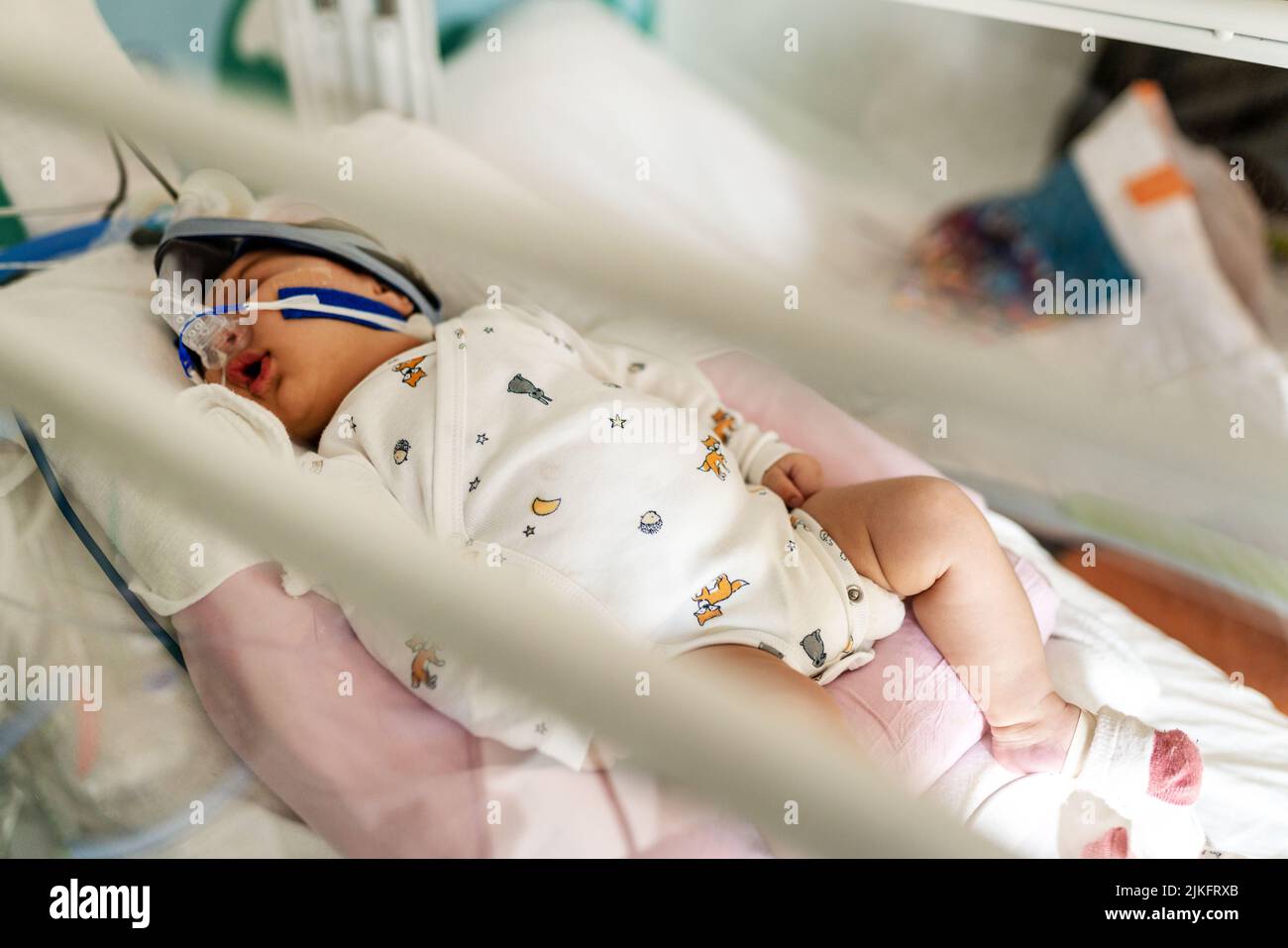 Infant in resuscitation for treatment of bronchiolitis in a hospital ...