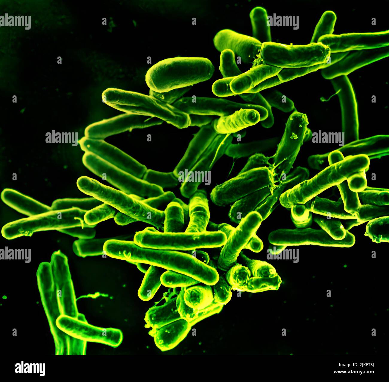Scanning electron micrograph of the bacterium Mycobacterium tuberculosis, which causes ...