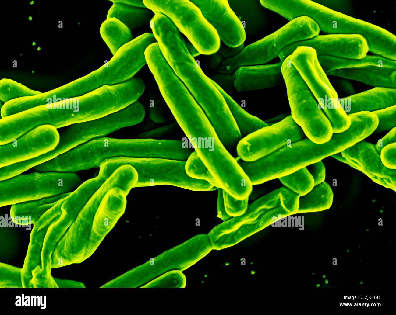 Scanning electron micrograph of the bacterium Mycobacterium tuberculosis, which causes ...