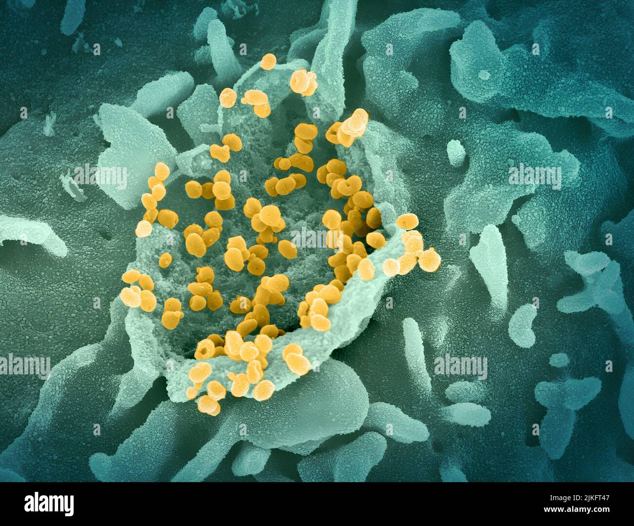 This scanning electron microscope image shows SARS-CoV-2 (round gold ...