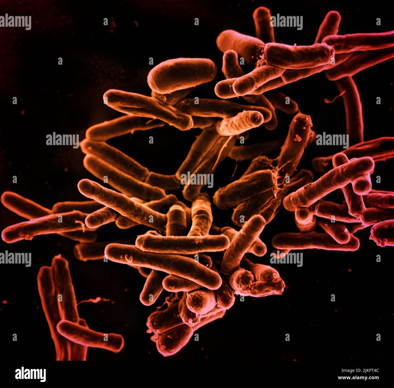Scanning electron micrograph of the bacterium Mycobacterium tuberculosis, which causes ...