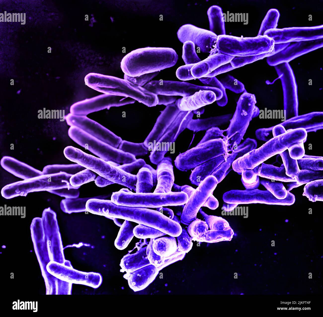 Scanning electron micrograph of the bacterium Mycobacterium tuberculosis, which causes ...