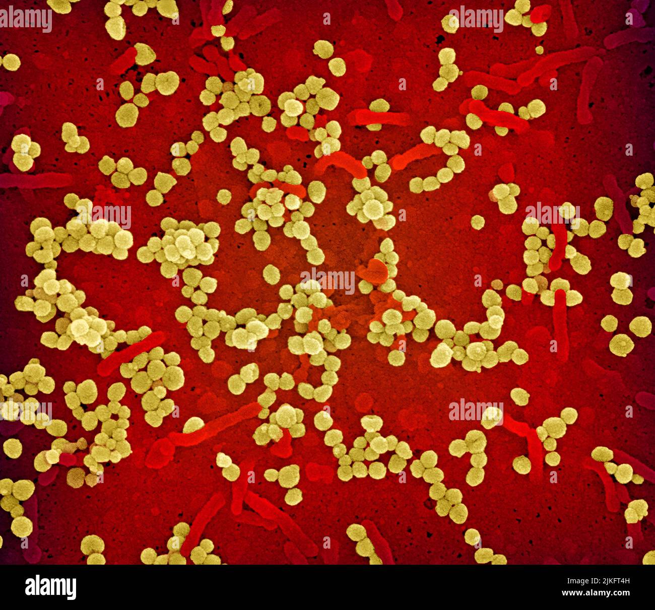 Vhf virus hi-res stock photography and images - Alamy
