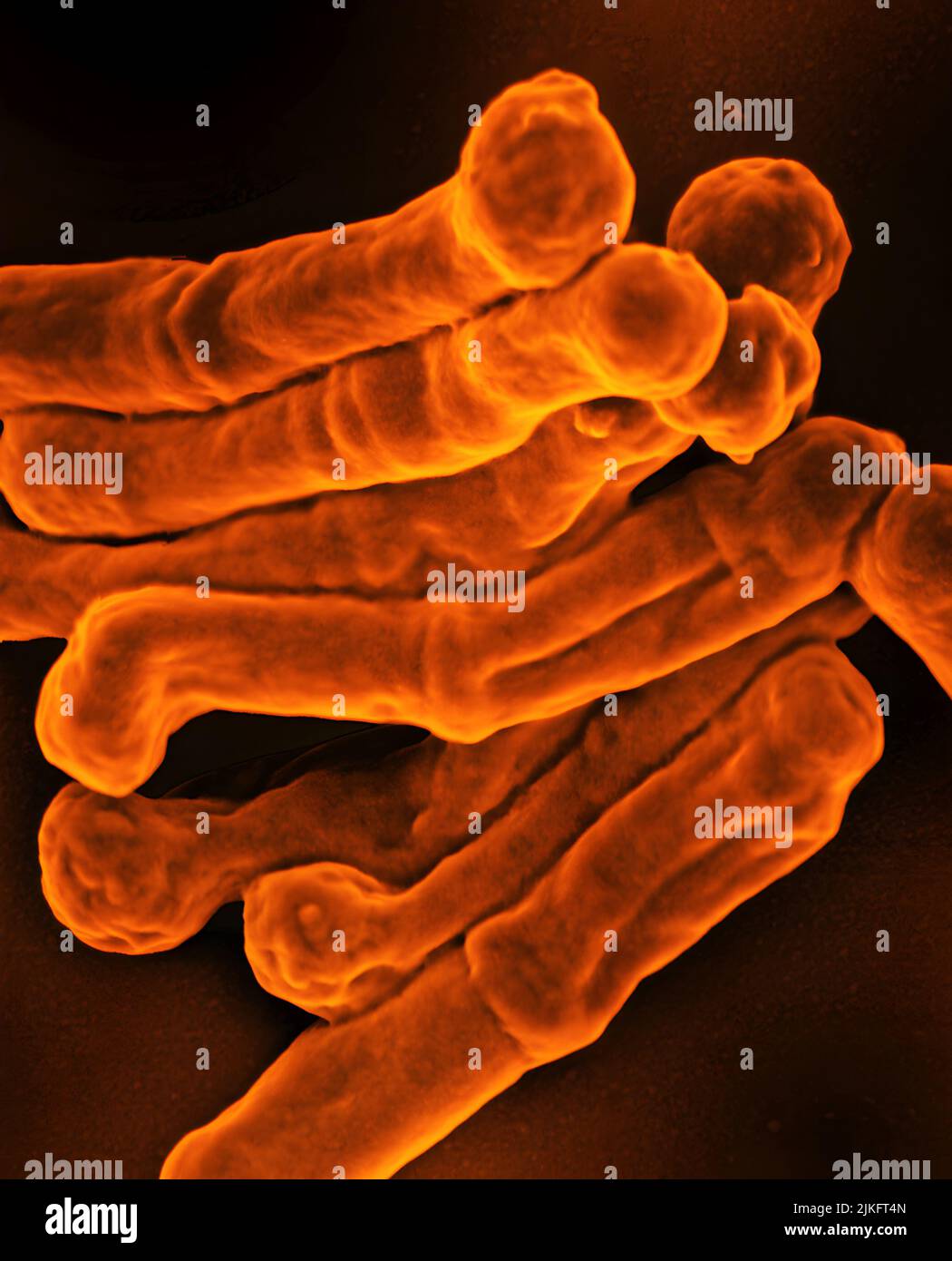 Scanning electron micrograph of the bacterium Mycobacterium ...
