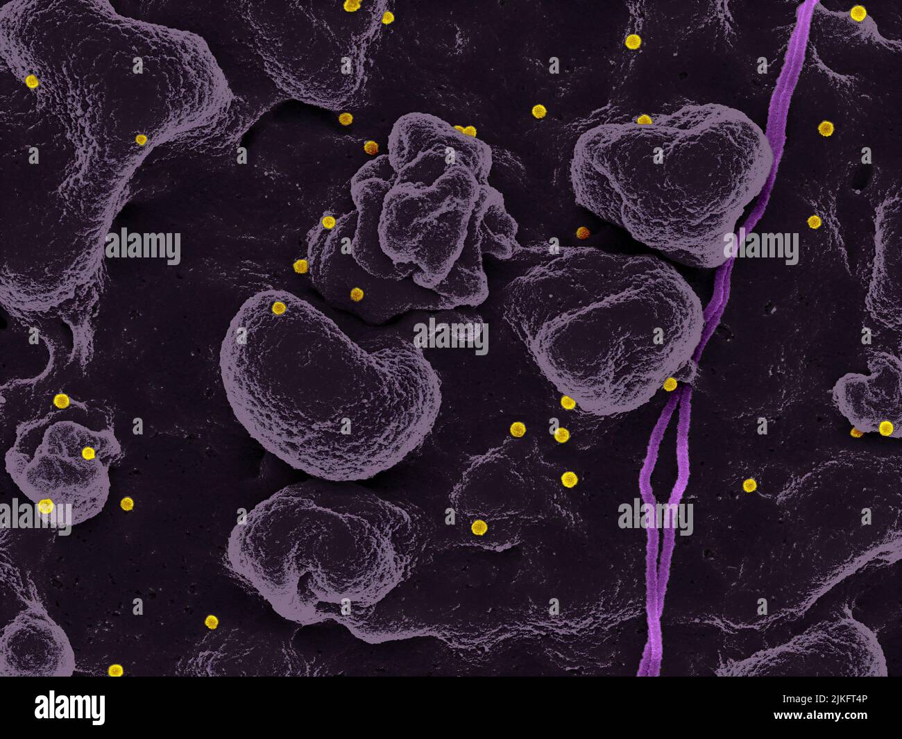 Epithelial cells micrograph hi-res stock photography and images - Alamy