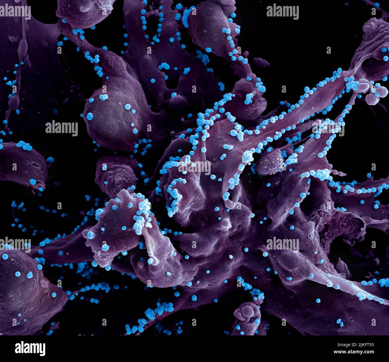Scanning electron micrograph of Lassa virus budding from a cell. Lassa ...