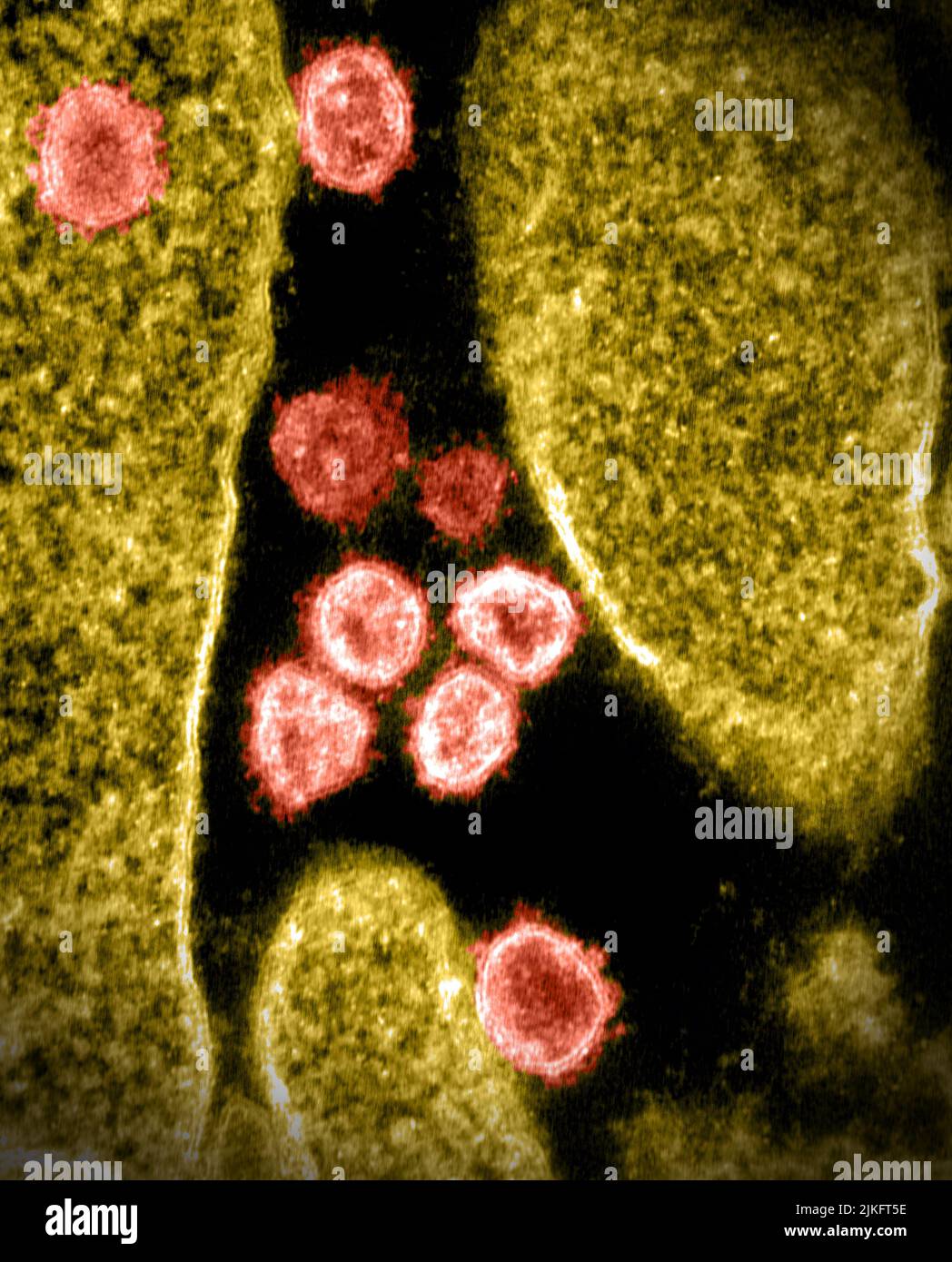 This transmission electron microscope image shows SARS-CoV-2 also known ...