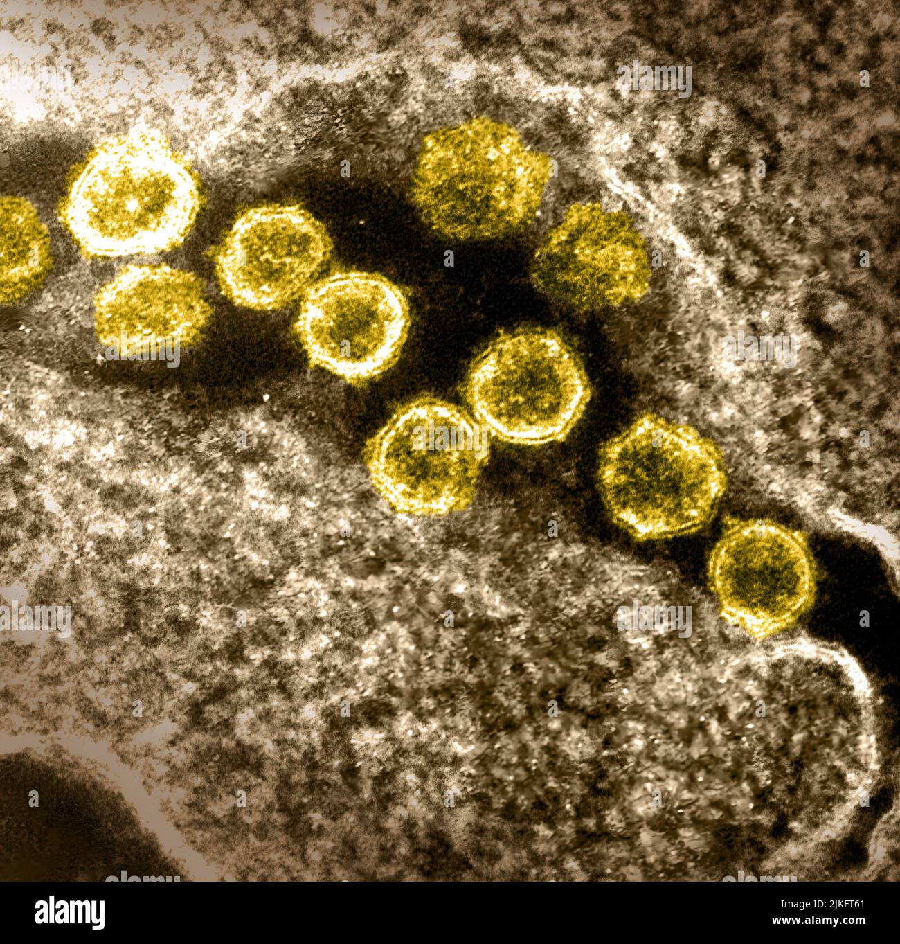 This transmission electron microscope image shows SARS-CoV-2 also known ...