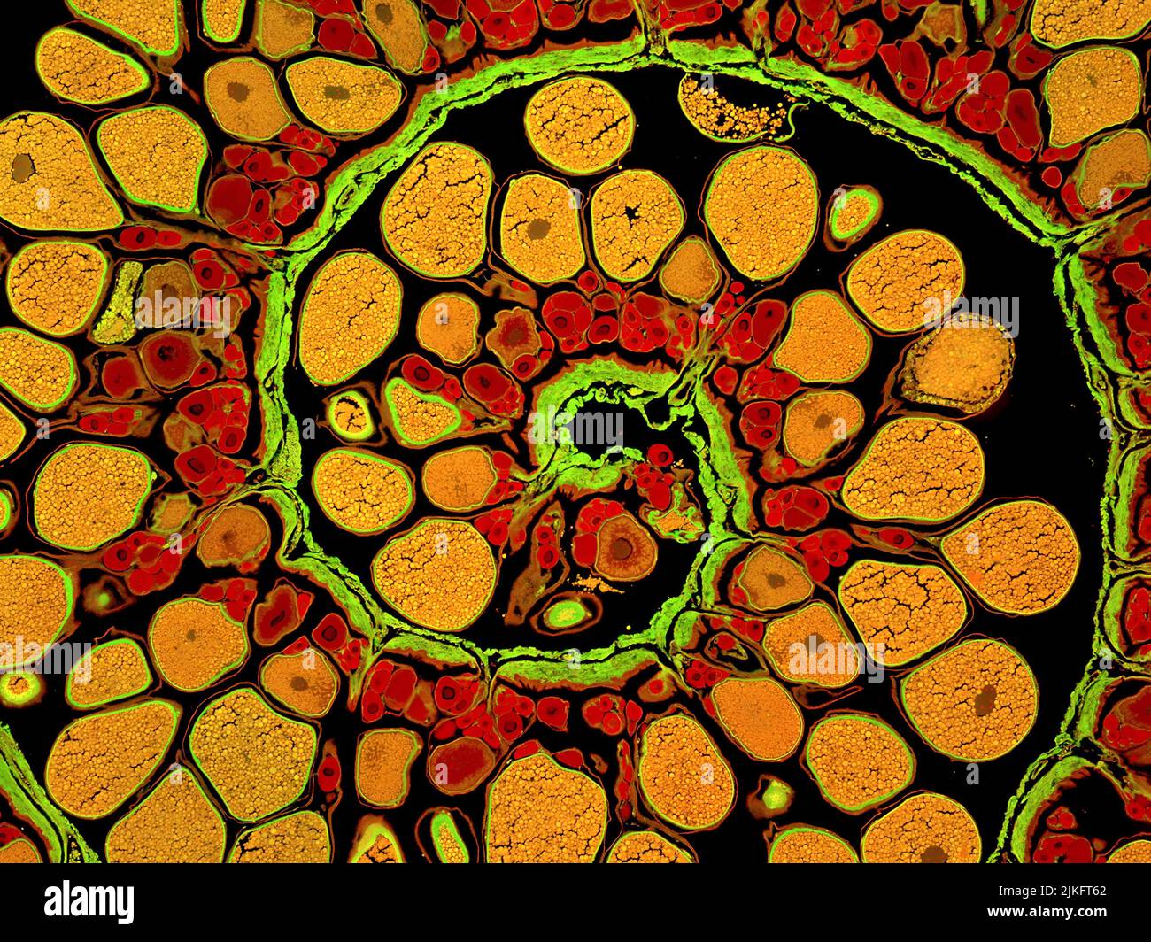 Ovairies hi-res stock photography and images - Alamy