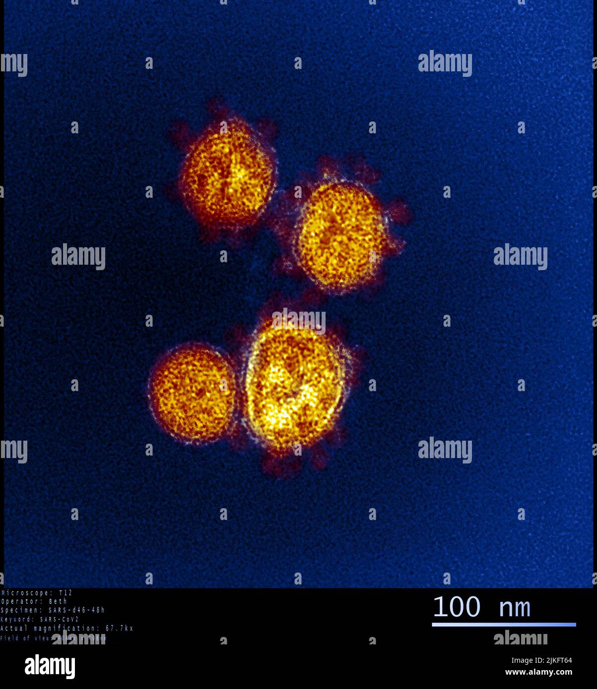 This transmission electron microscope image shows SARS-CoV-2 also known ...